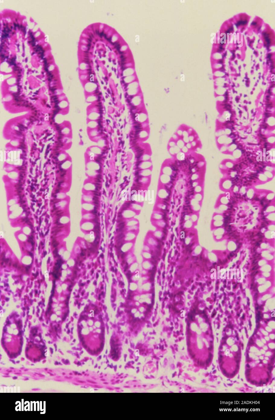 Function Of Crypts Of Lieberkuhn In Histology An Intestinal Gland