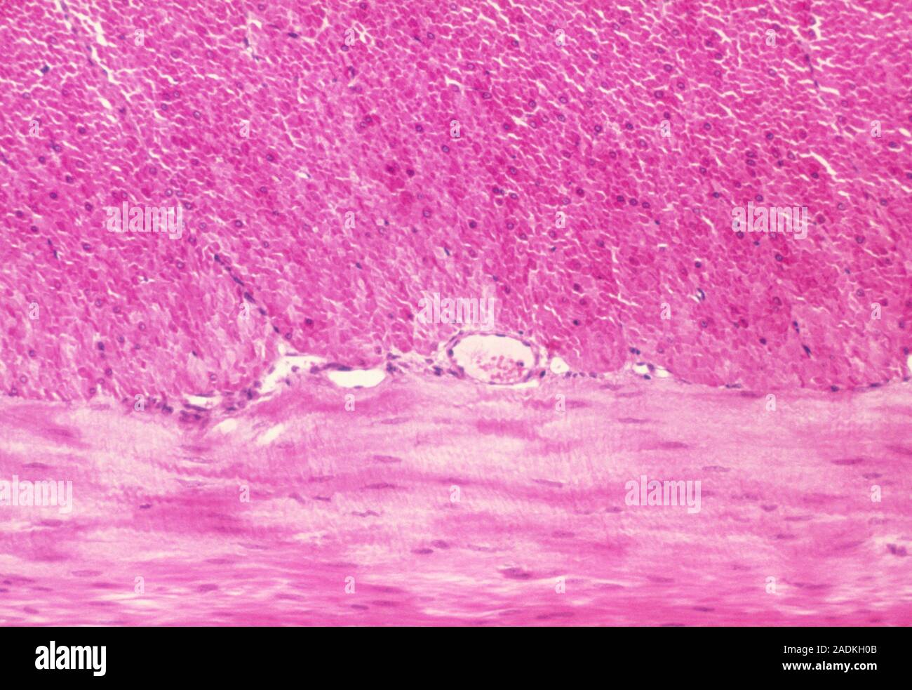 Small intestine muscle layers. Light micrograph of a longitudinal ...