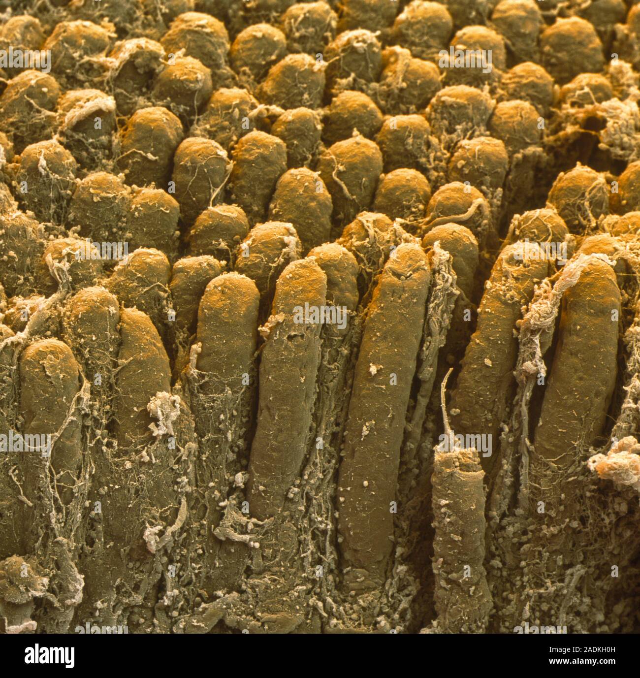 Small intestine. Scanning electron micrograph (SEM) showing the villi ...