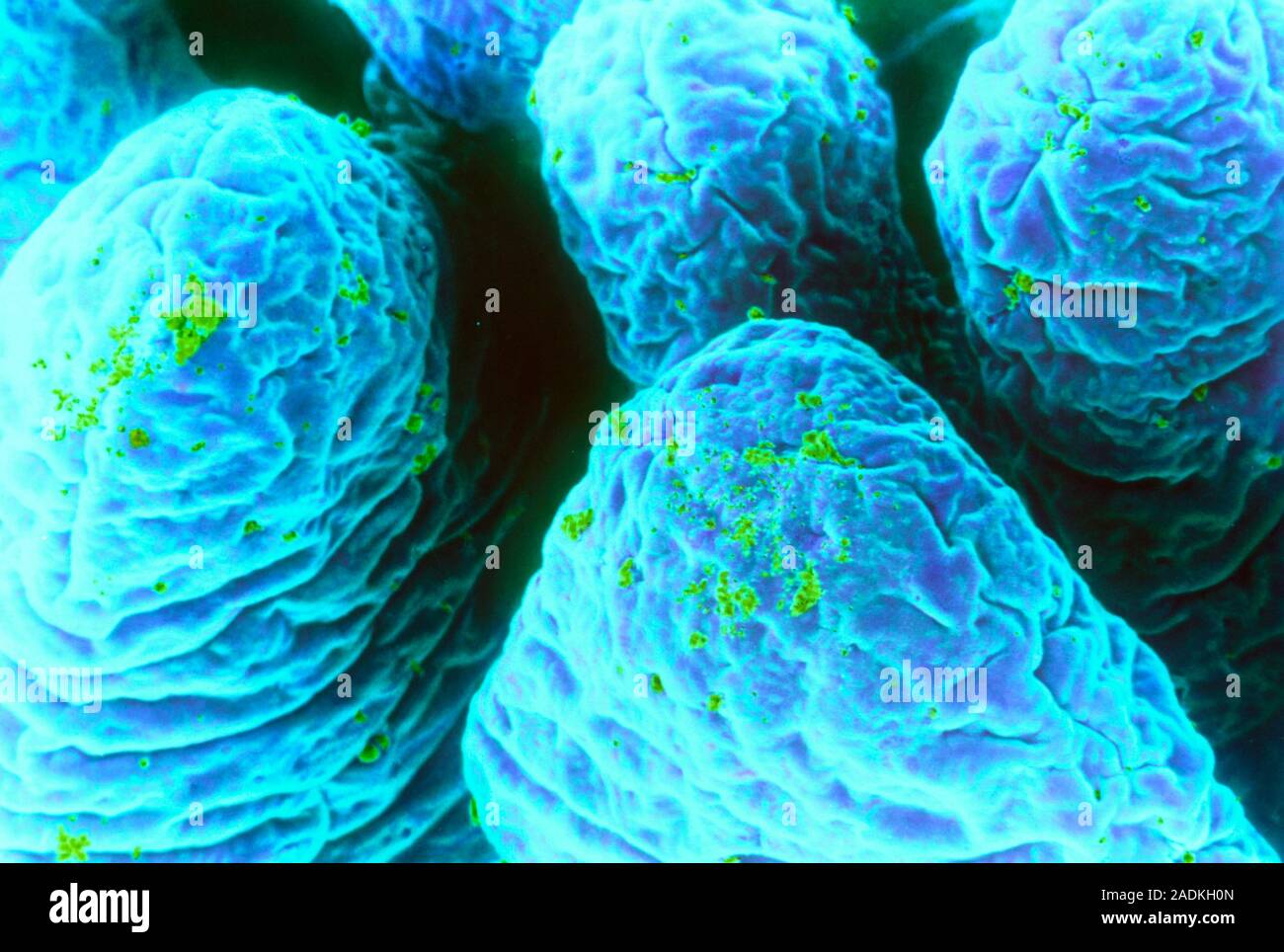 Small intestine. Coloured scanning electron micrograph (SEM) showing ...