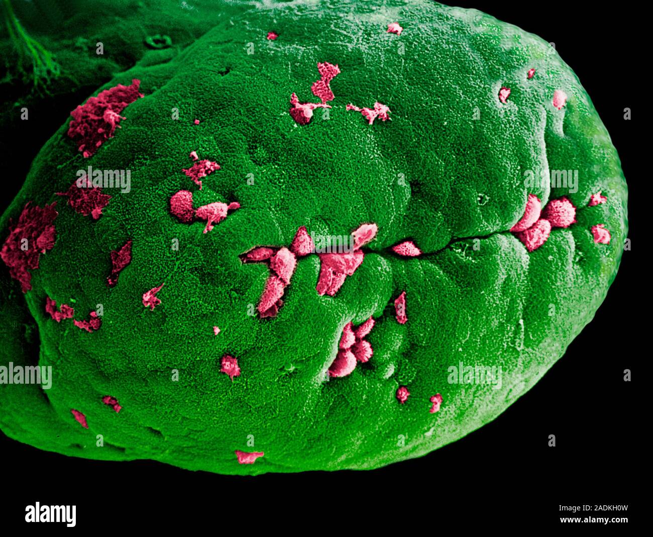 Villus of small intestine. Coloured scanning electron micrograph (SEM ...
