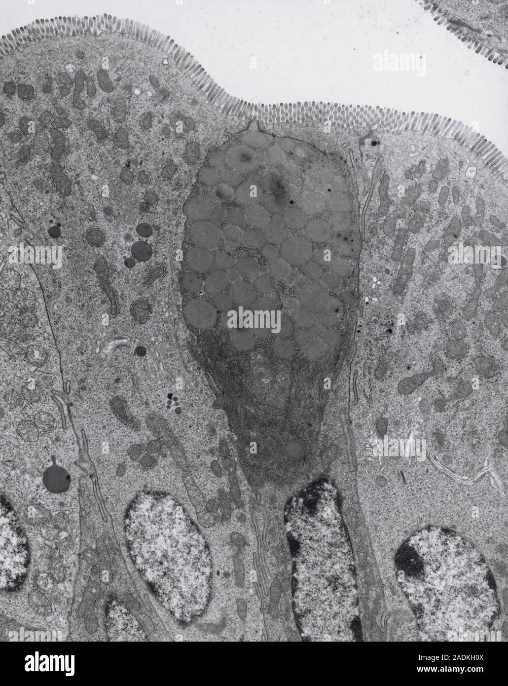 Goblet and secretory cells. Transmission electron micrograph (TEM) of a ...