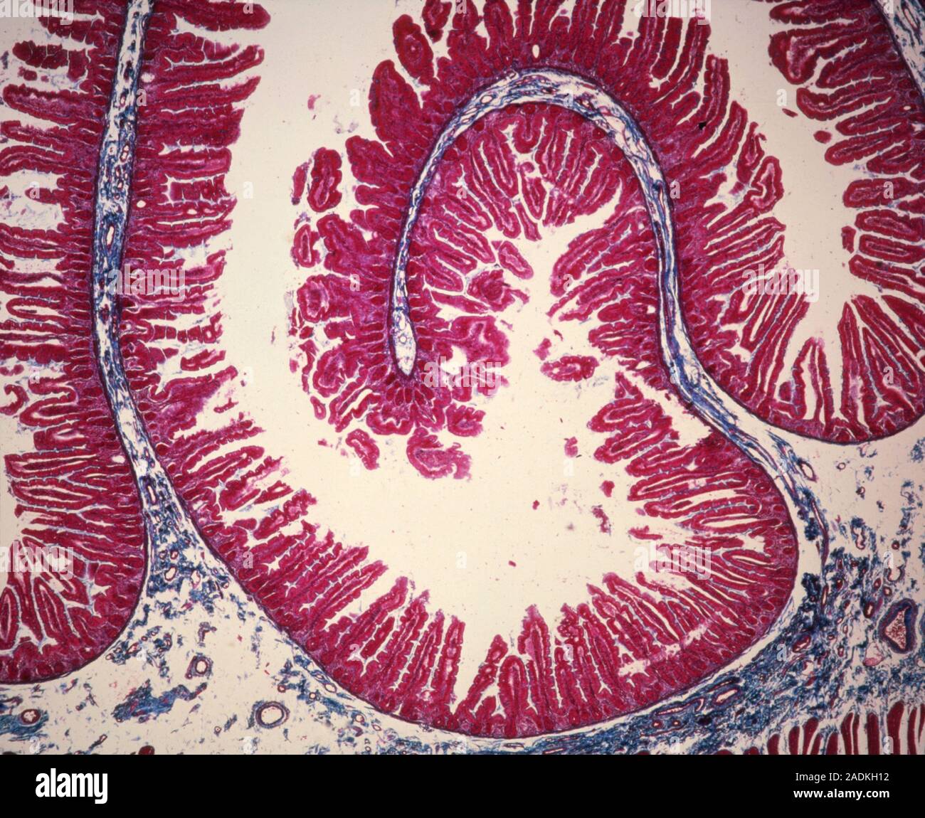 Small intestine. Light micrograph of a section through the jejunum of ...