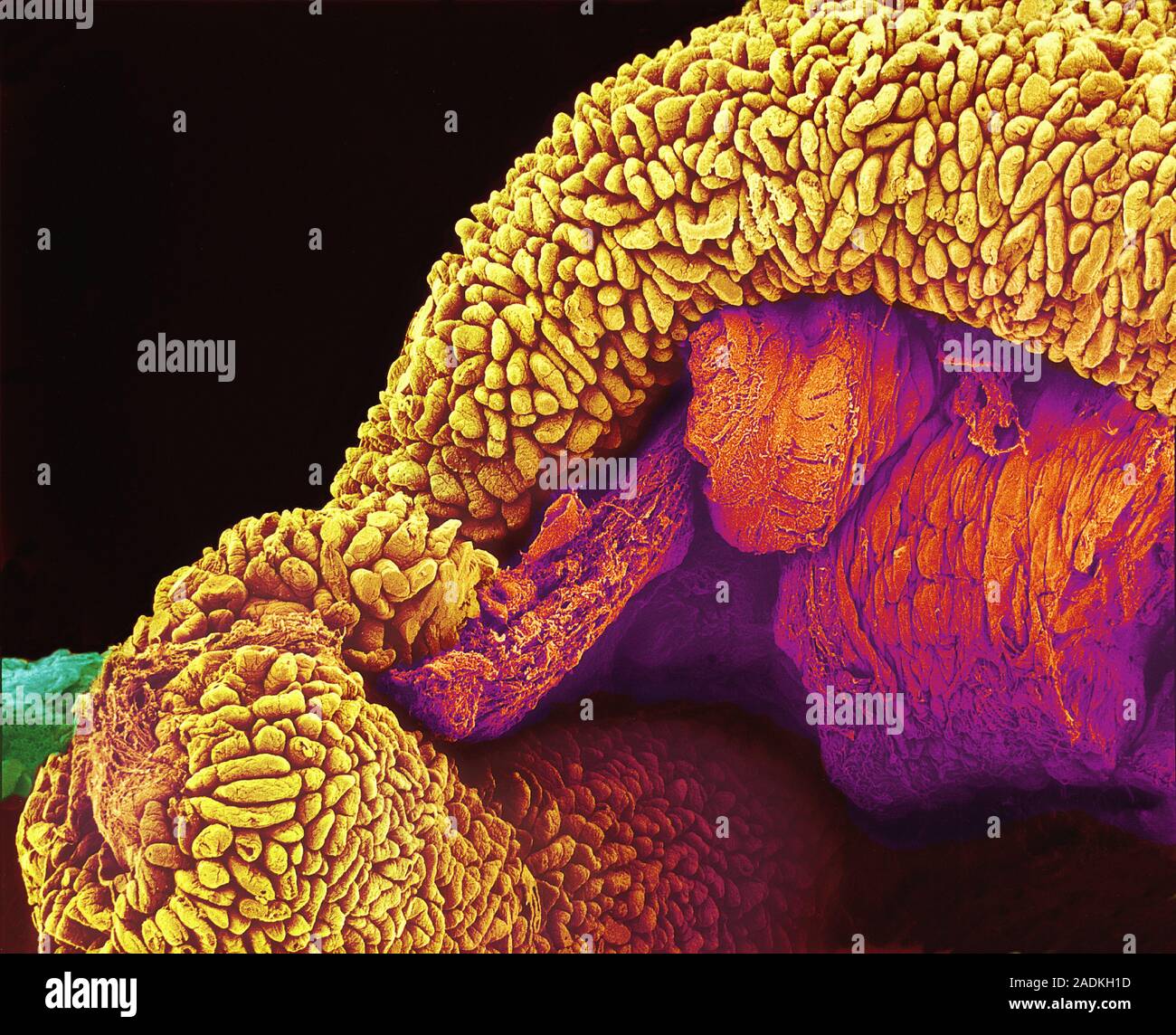 Small intestine. Coloured scanning electron micrograph (SEM) of the ...