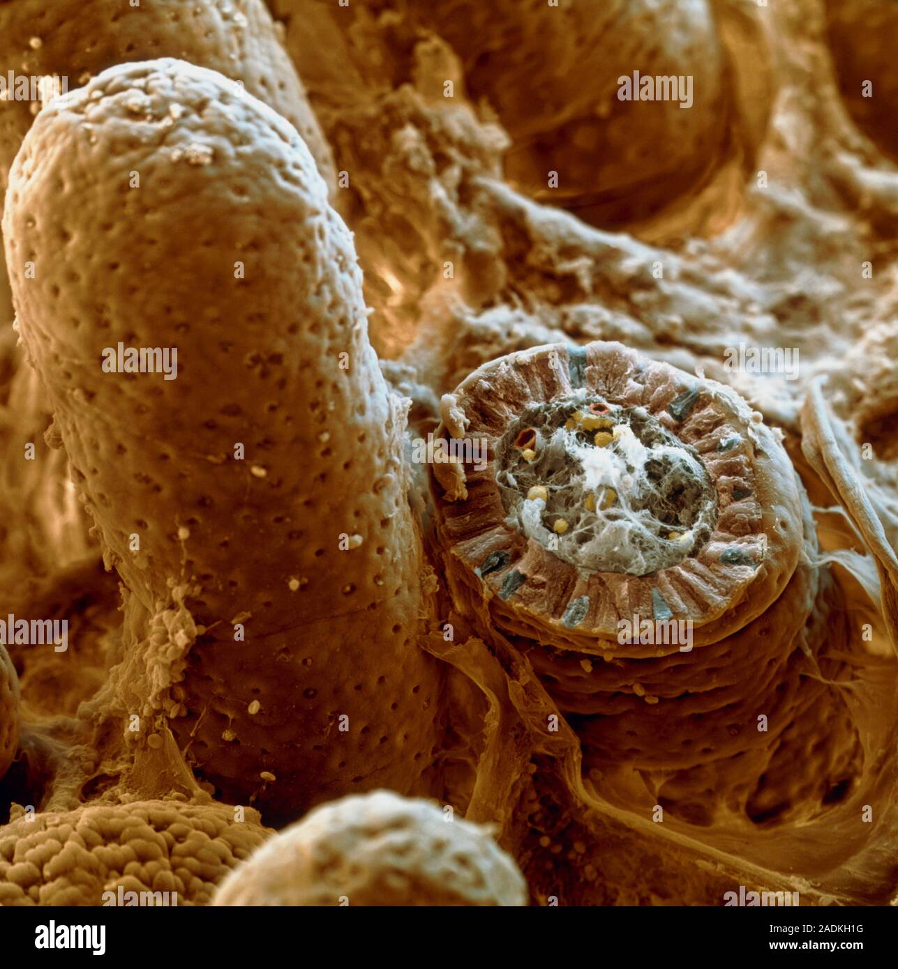 Small intestine villi. Coloured scanning electron micrograph (SEM) of ...