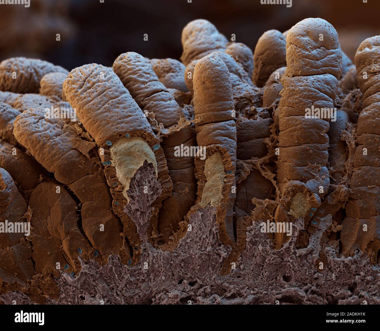 Small intestine villi. Coloured scanning electron micrograph (SEM) of ...