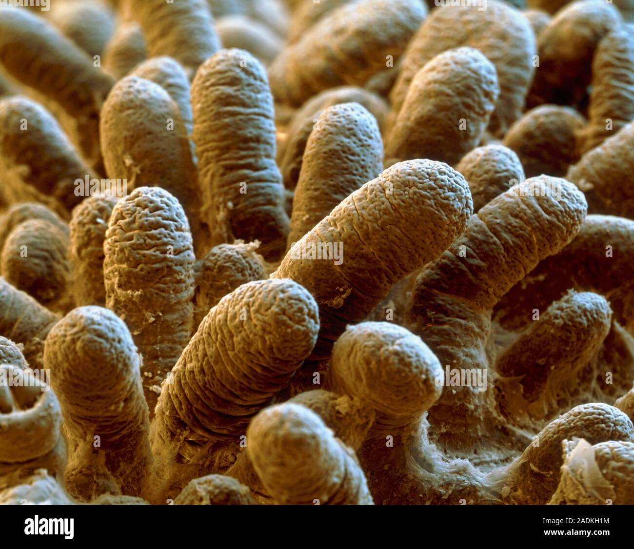 Small intestine villi. Coloured scanning electron micrograph (SEM) of ...