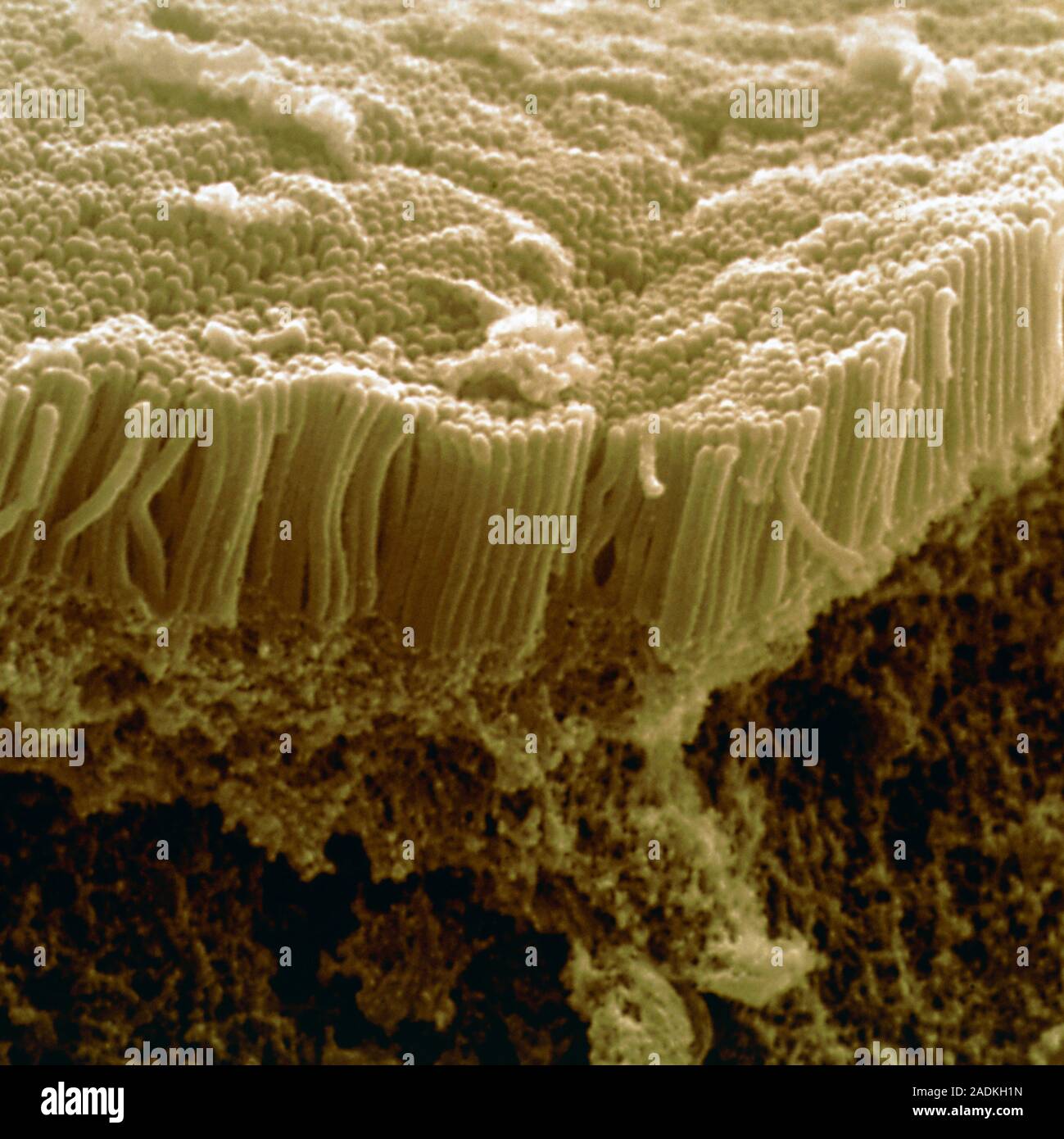 Small intestine microvilli. Coloured scanning electron micrograph (SEM ...