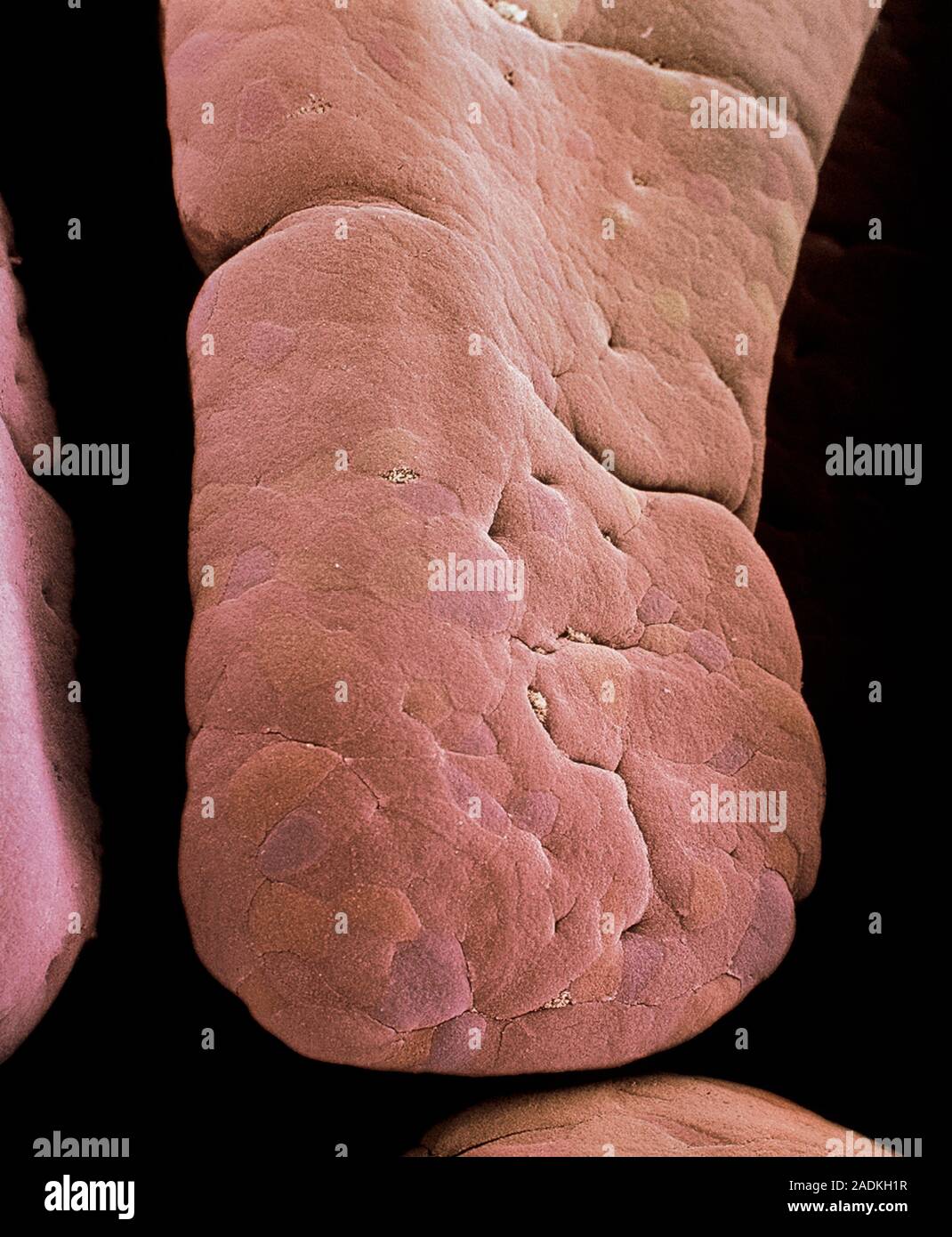 Small intestine villus. Coloured scanning electron micrograph (SEM) of ...