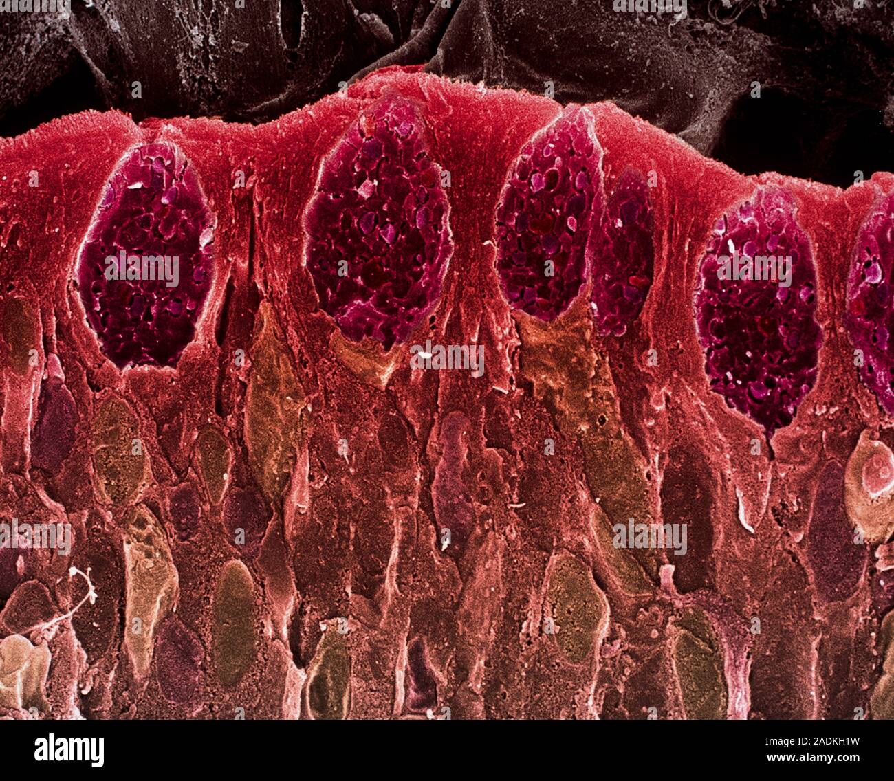 Small intestine villus. Coloured scanning electron micrograph (SEM) of ...
