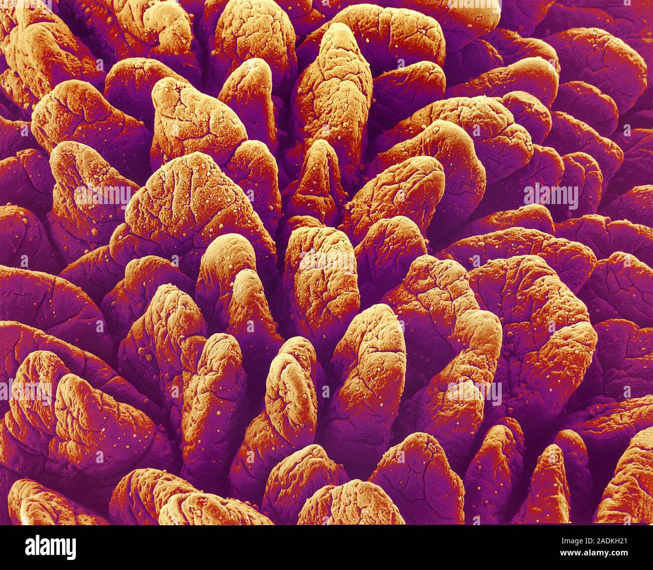 Small intestine villi. Coloured scanning electron micrograph (SEM) of ...