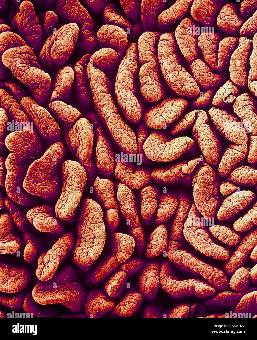 Small intestine villi. Coloured scanning electron micrograph (SEM) of ...