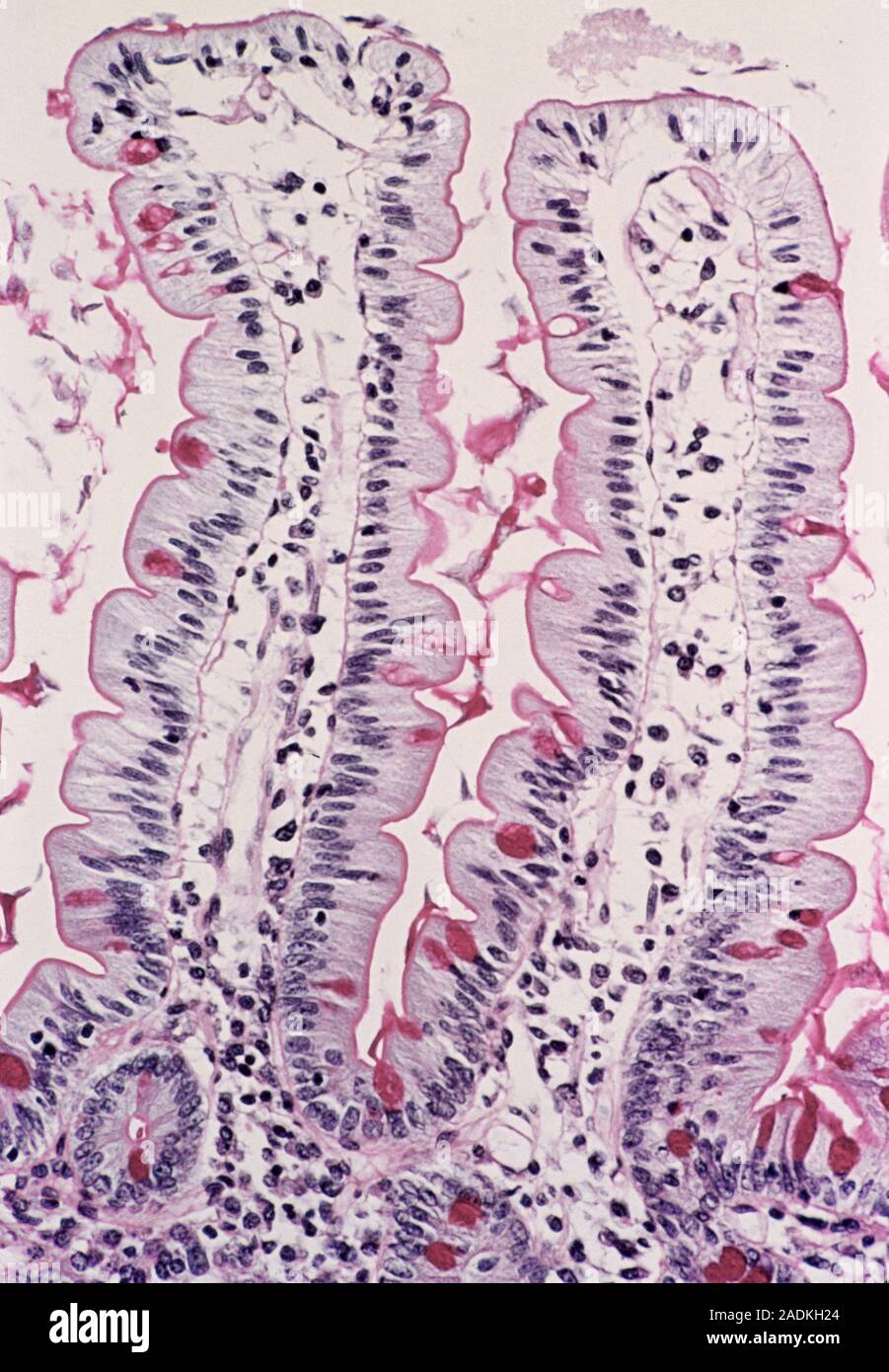 Small intestine lining. Light micrograph of a section through the ...