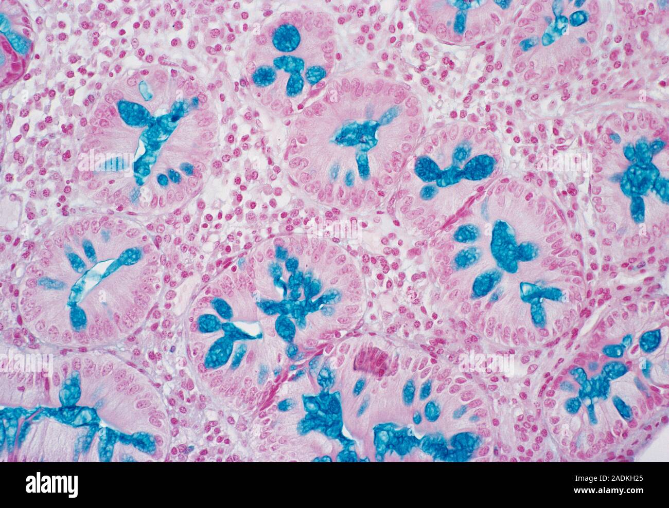 Small intestine lining. Light micrograph of a cross-section through the ...