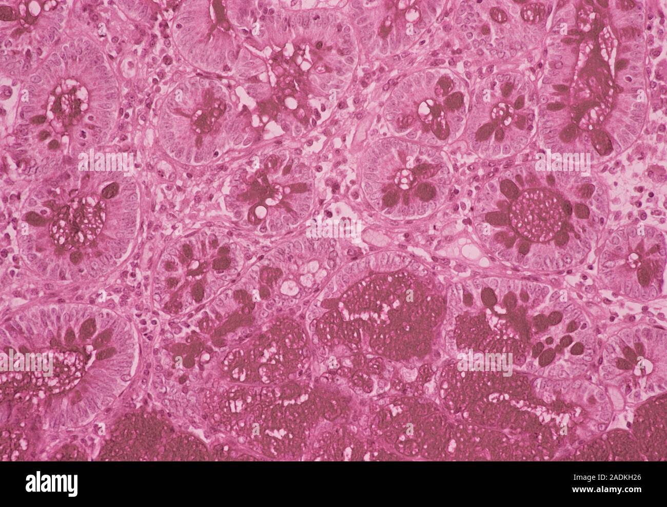Small intestine lining. Light micrograph of a cross-section through the ...