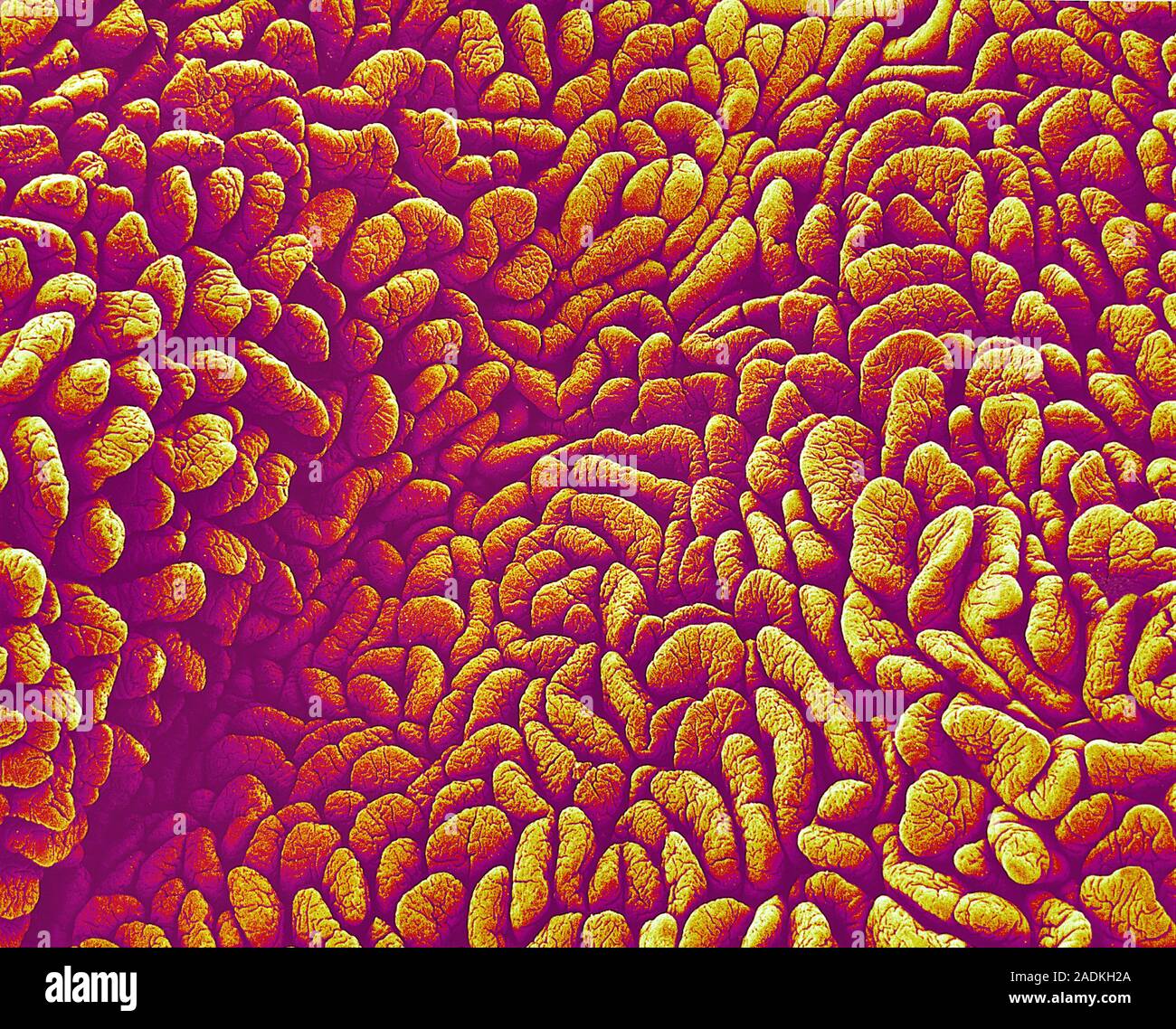 Small intestine villi. Coloured scanning electron micrograph (SEM) of ...