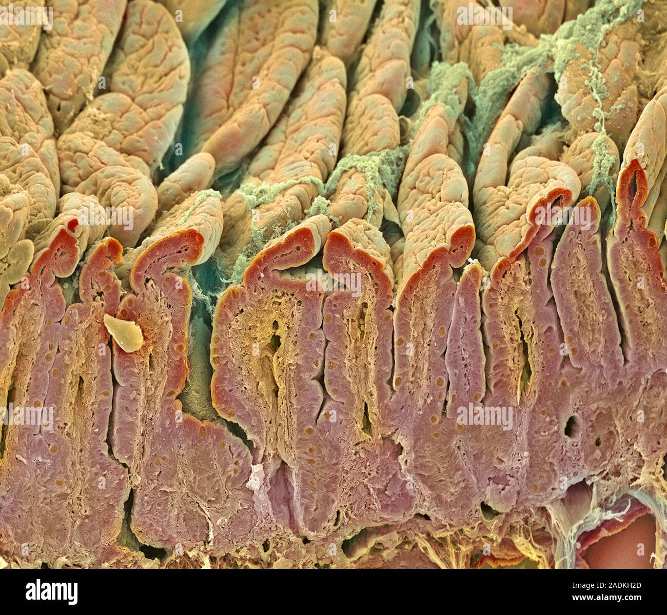 Intestinal lining. Coloured scanning electron micrograph (SEM) of a ...