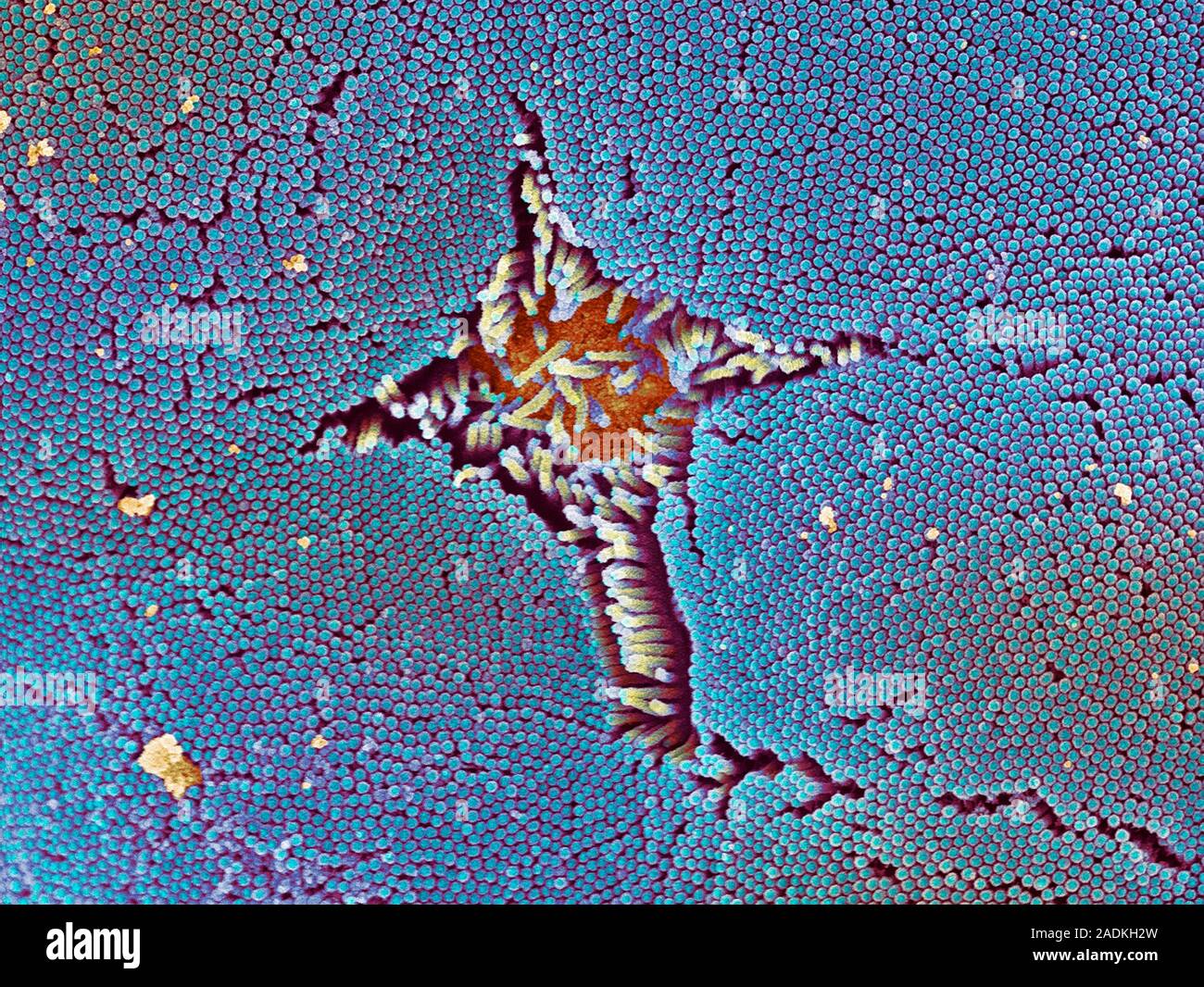 Small intestine lining. Coloured scanning electron micrograph (SEM) of ...