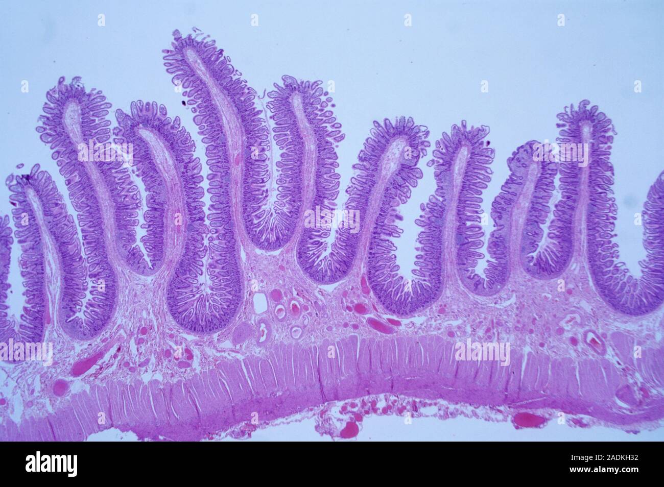 Intestinal lining. Light micrograph of a section through the wall of ...