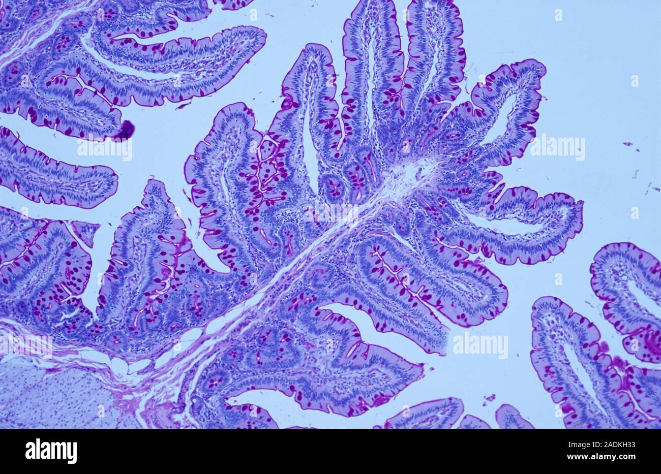 Intestinal lining. Light micrograph of villi on the lining of the ...