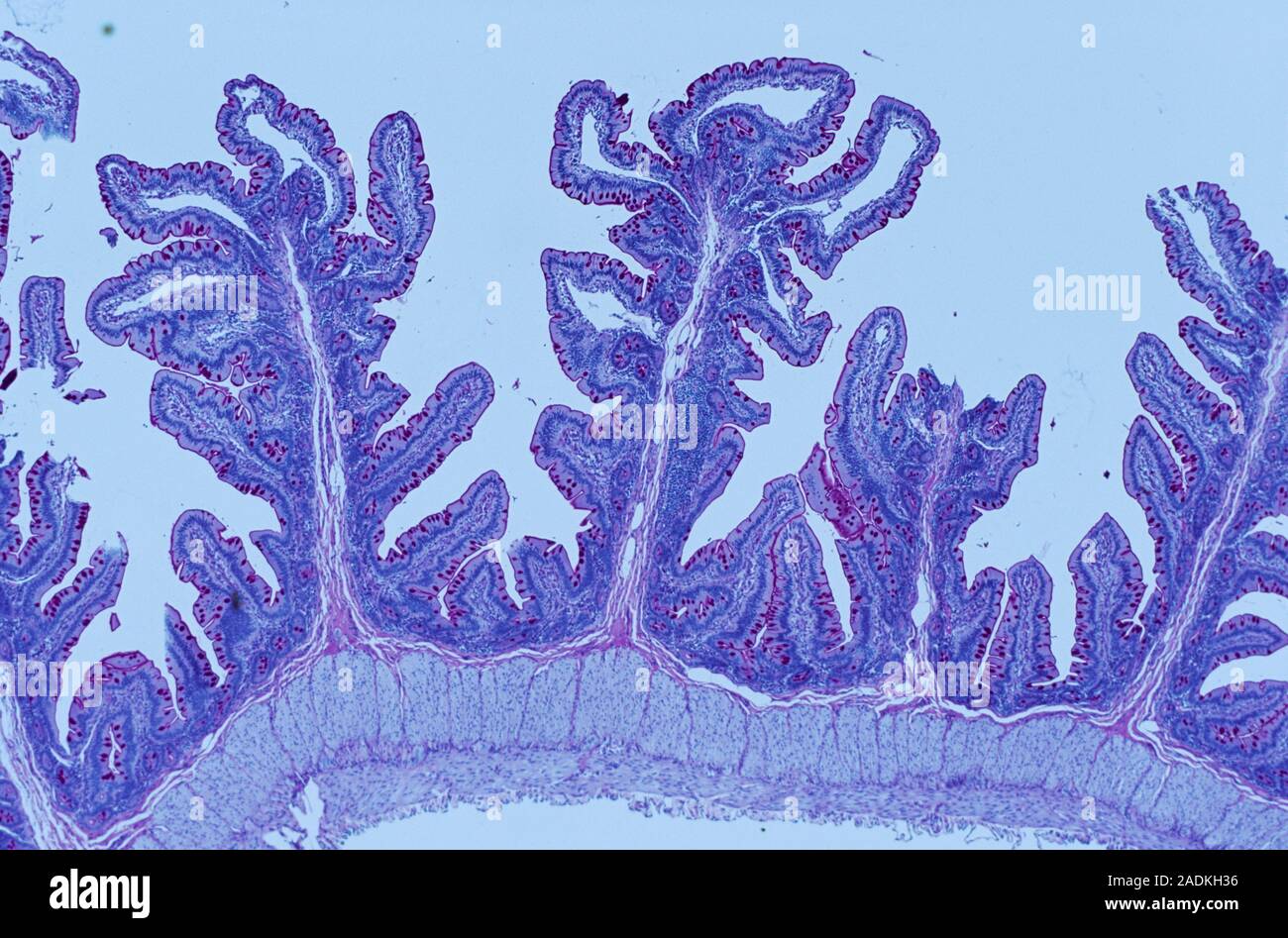 Small intestine. Light micrograph of a section through the jejunum ...