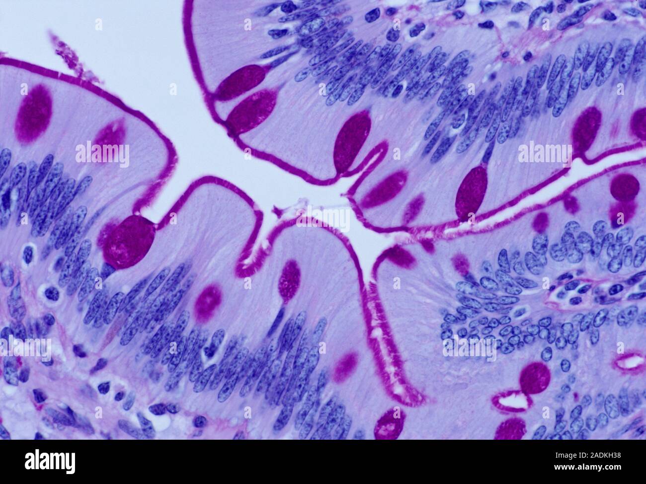 Small intestine. Light micrograph of a section through the small ...