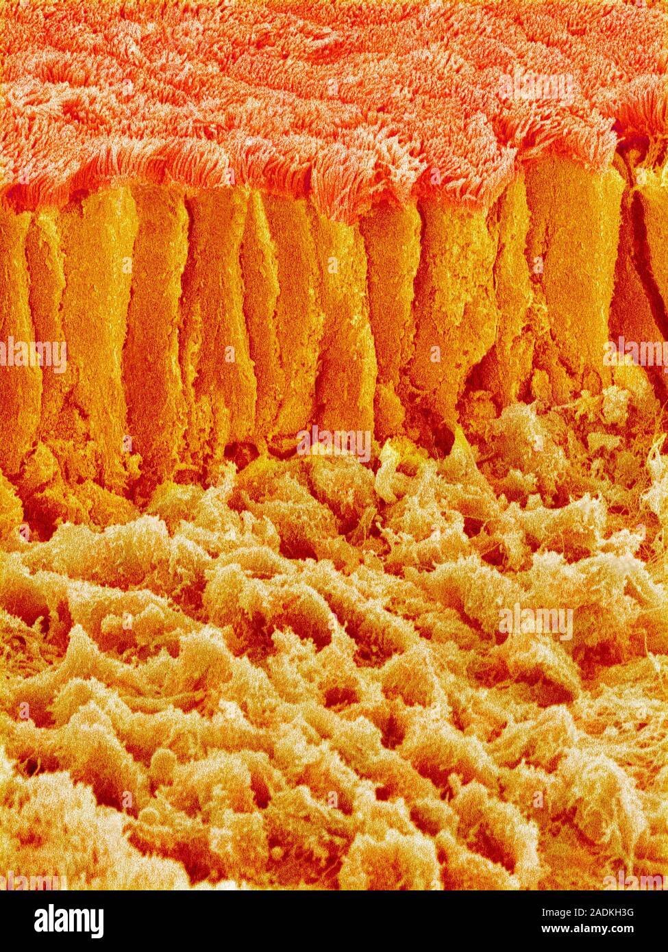 Microvilli in the intestine. Coloured scanning electron micrograph (SEM ...