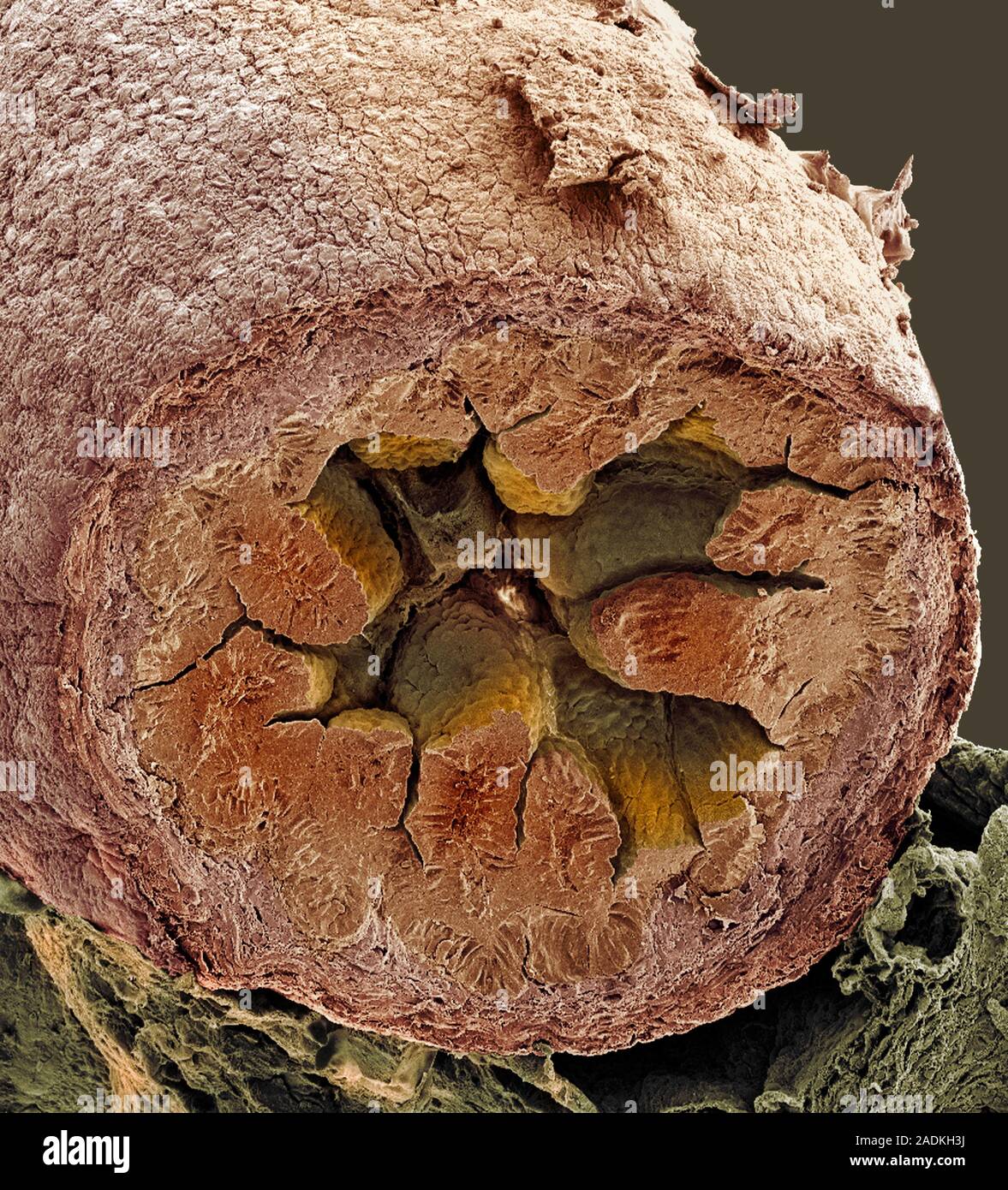 Small intestine. Coloured scanning electron micrograph (SEM) of a cross ...