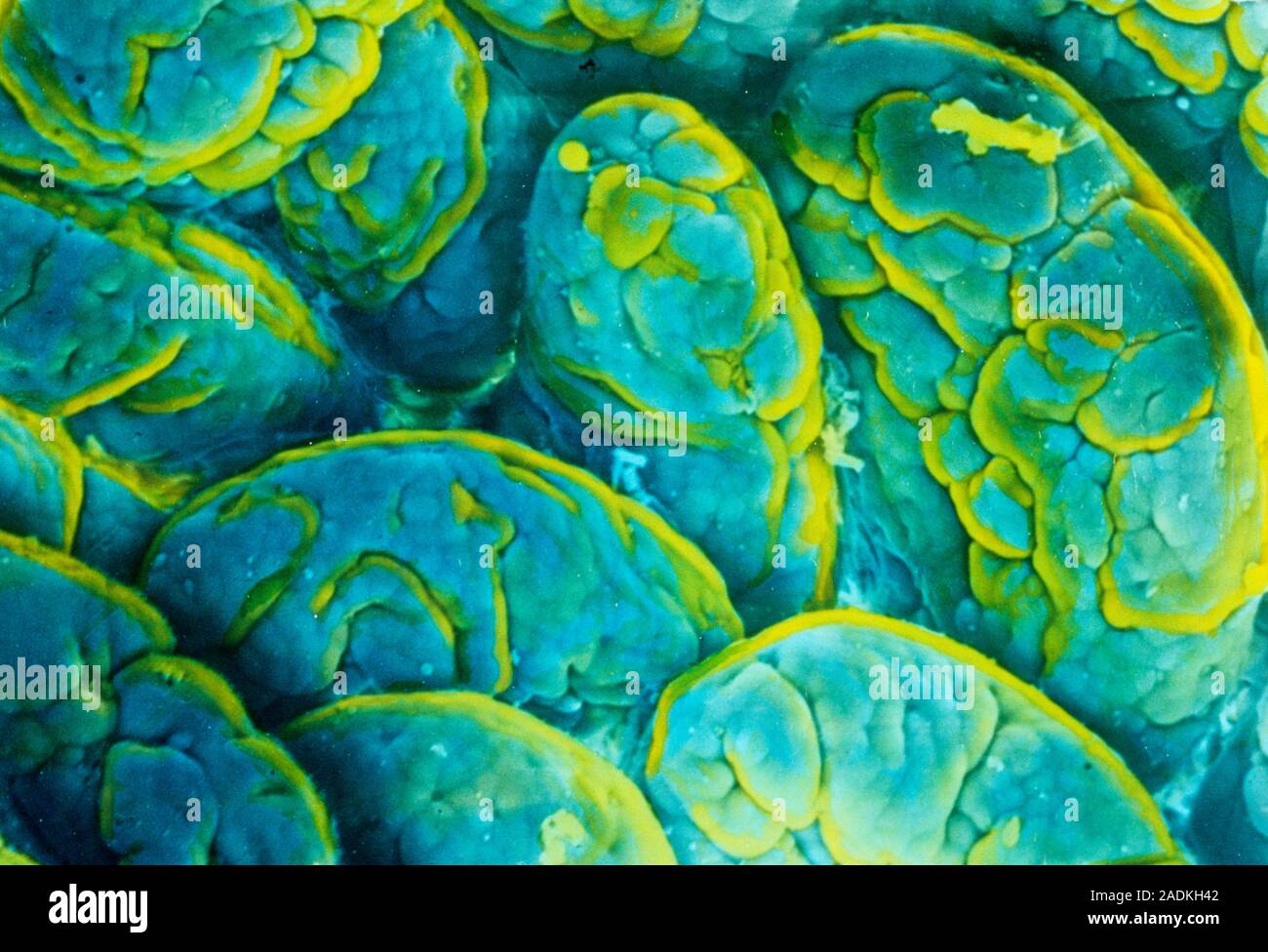 Intestinal microvilli. Coloured scanning electron micrograph (SEM) of ...