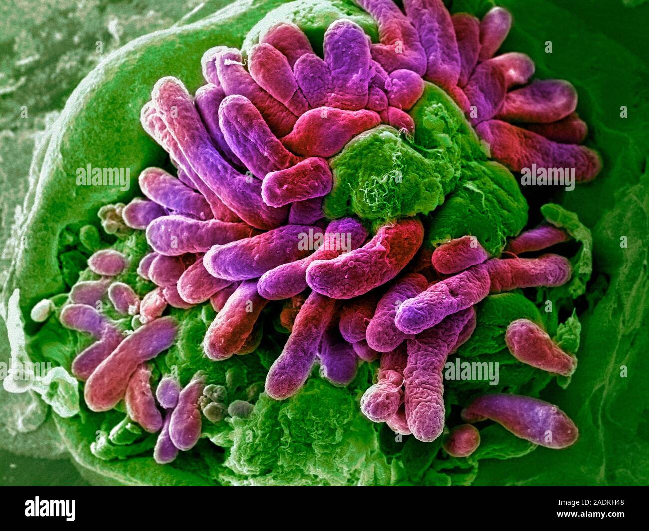 Small intestine. Coloured scanning electron micrograph (SEM) of a ...