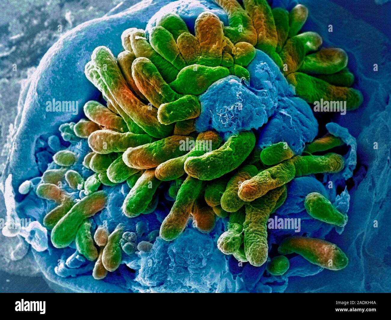 Small intestine. Coloured scanning electron micrograph (SEM) of a ...