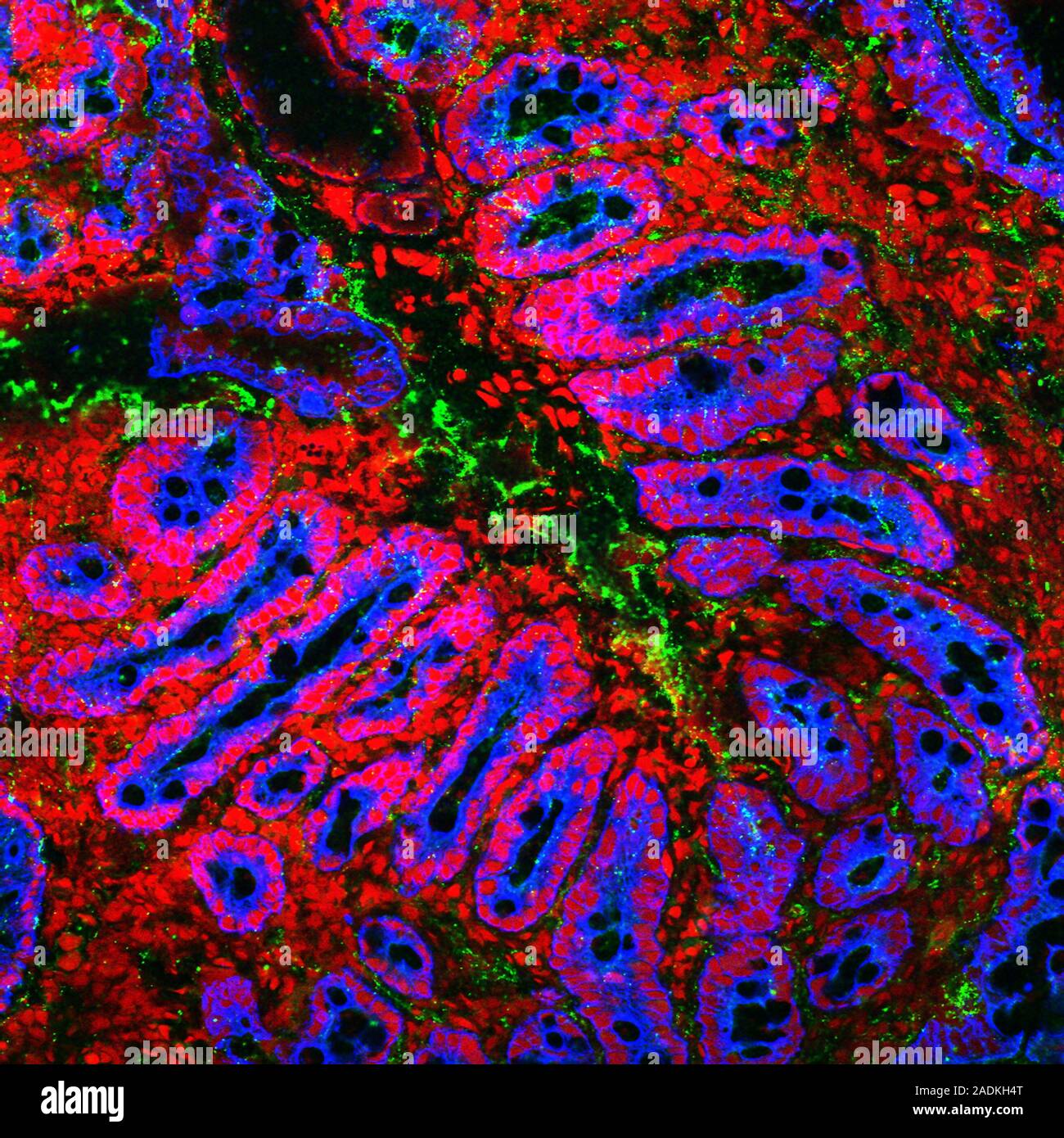 Small intestine. Fluorescence confocal light micrograph of a vertical ...