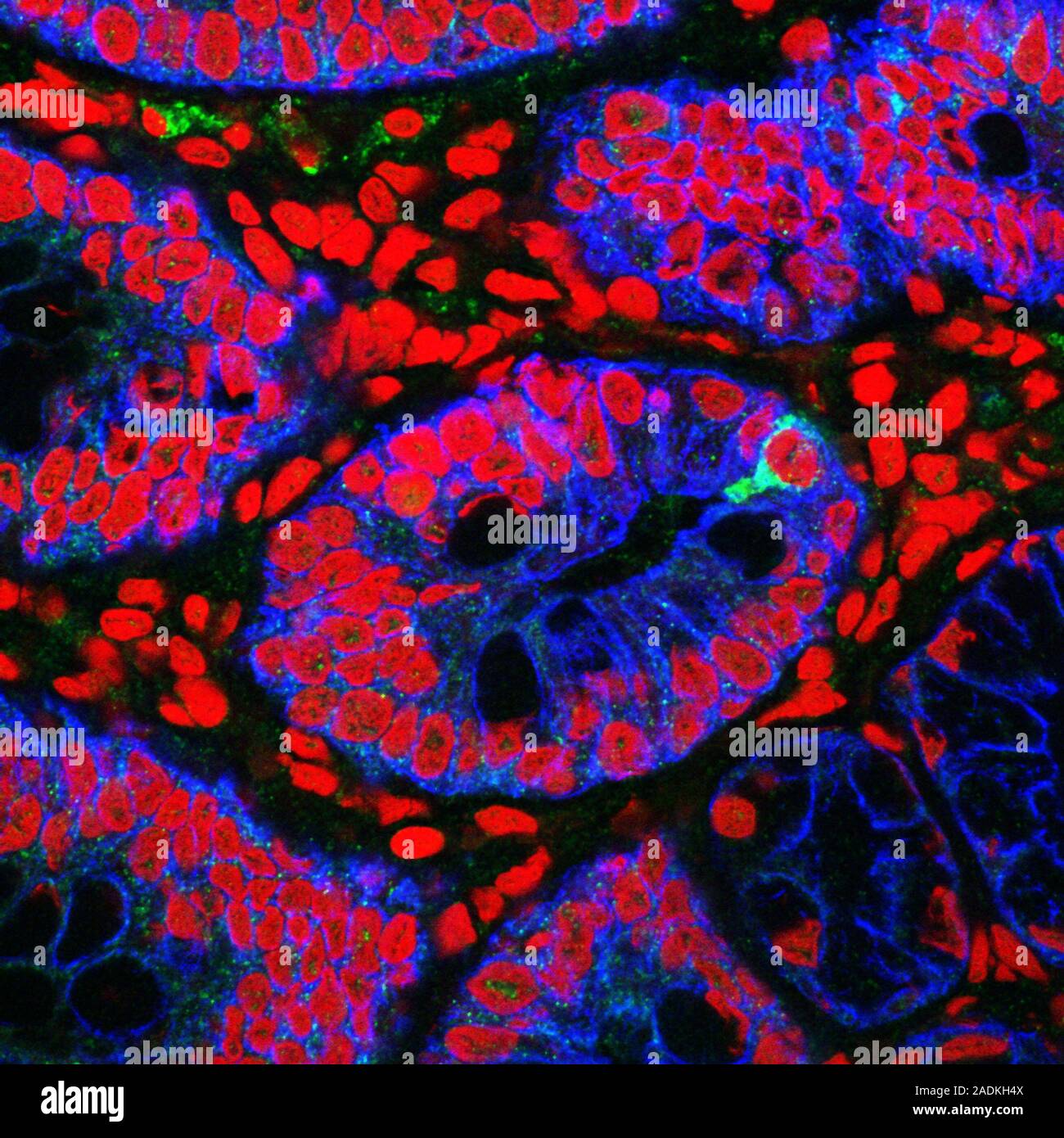 Small intestine. Fluorescence confocal light micrograph of a horizontal ...