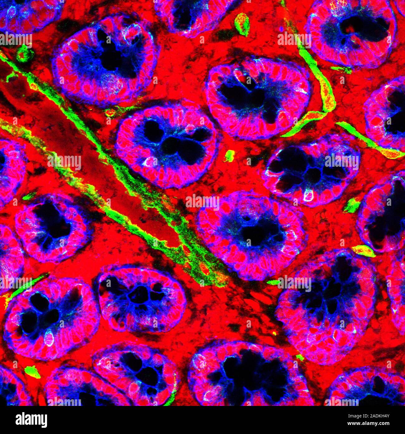 Small intestine. Fluorescence confocal light micrograph of a horizontal ...