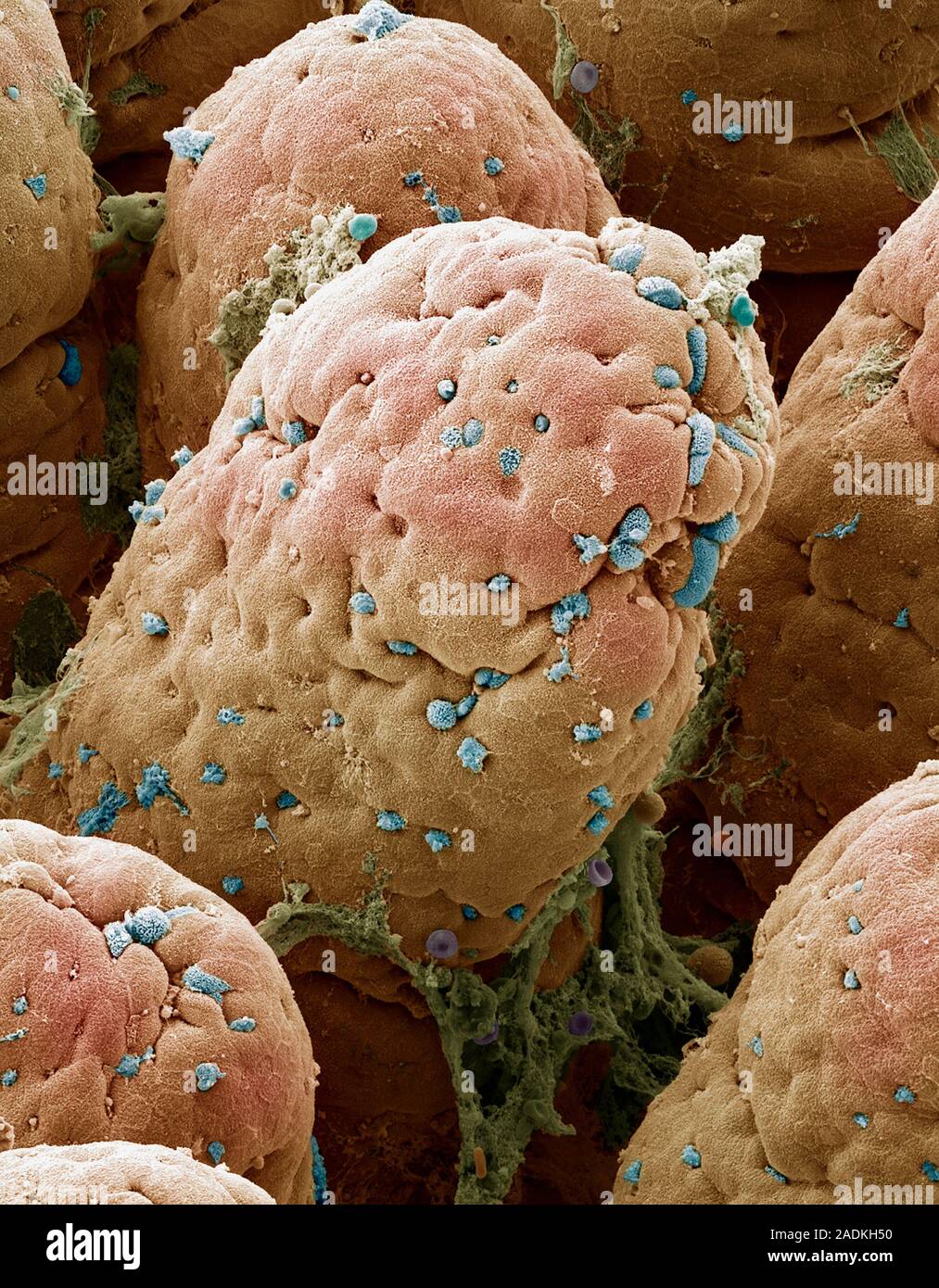 Intestinal lining. Coloured scanning electron micrograph (SEM) of villi ...