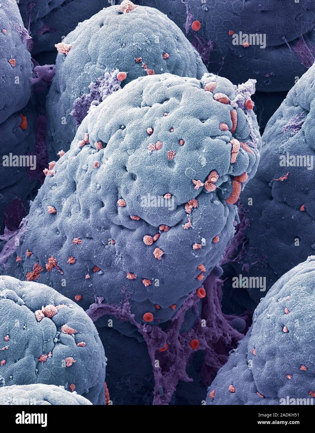 Intestinal lining. Coloured scanning electron micrograph (SEM) of villi ...
