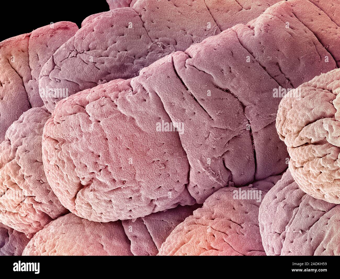 Intestinal lining. Coloured scanning electron micrograph (SEM) of villi ...