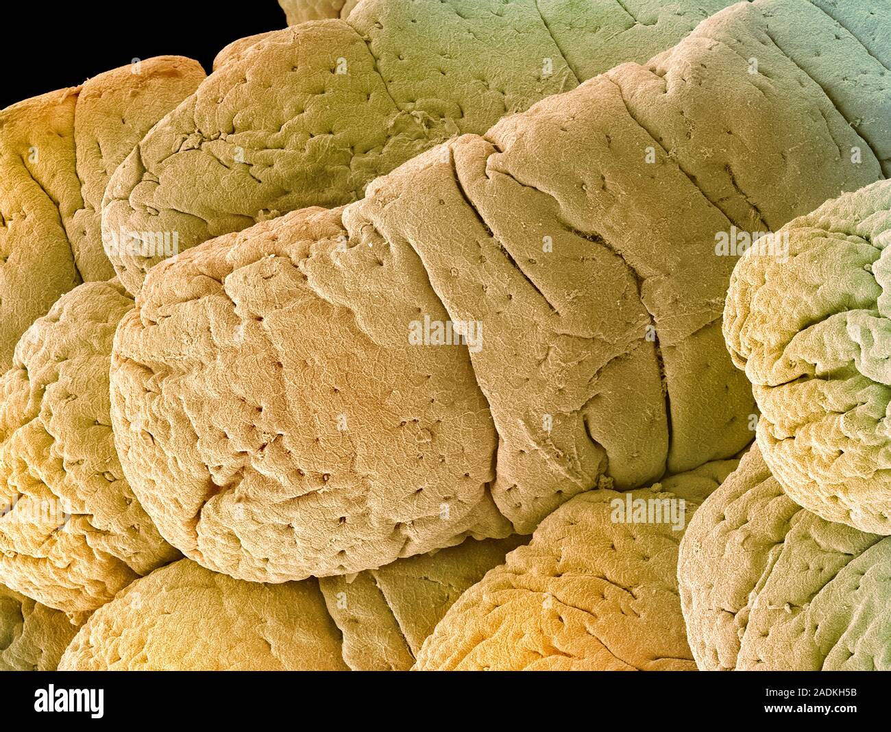 Intestinal lining. Coloured scanning electron micrograph (SEM) of villi ...
