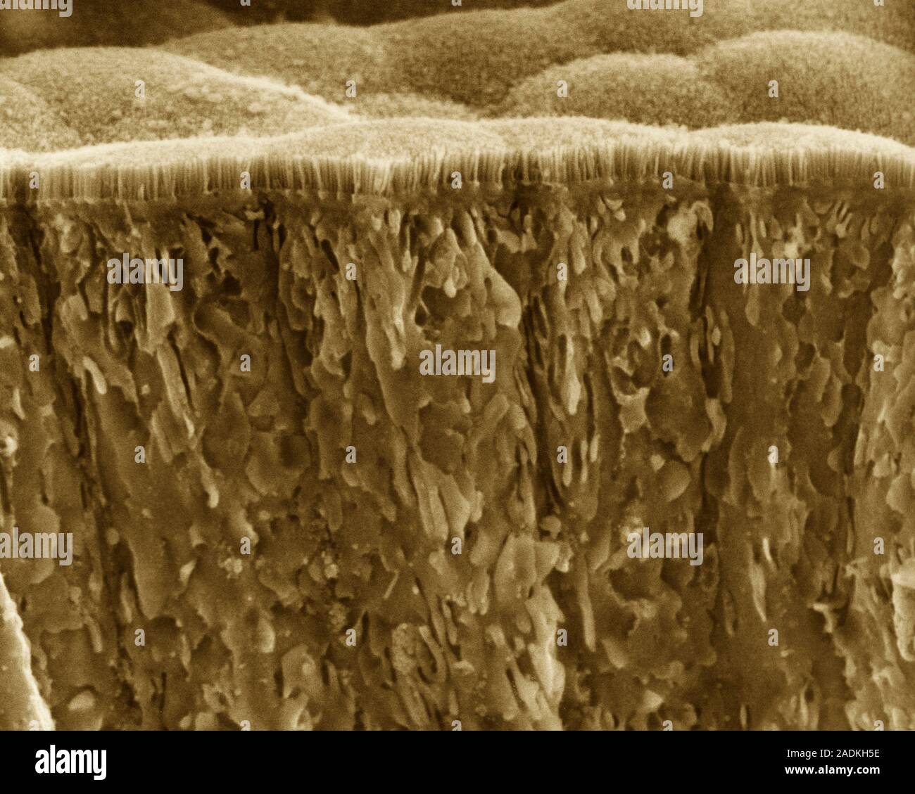 Microvilli in the small intestine, coloured freeze-fracture scanning ...