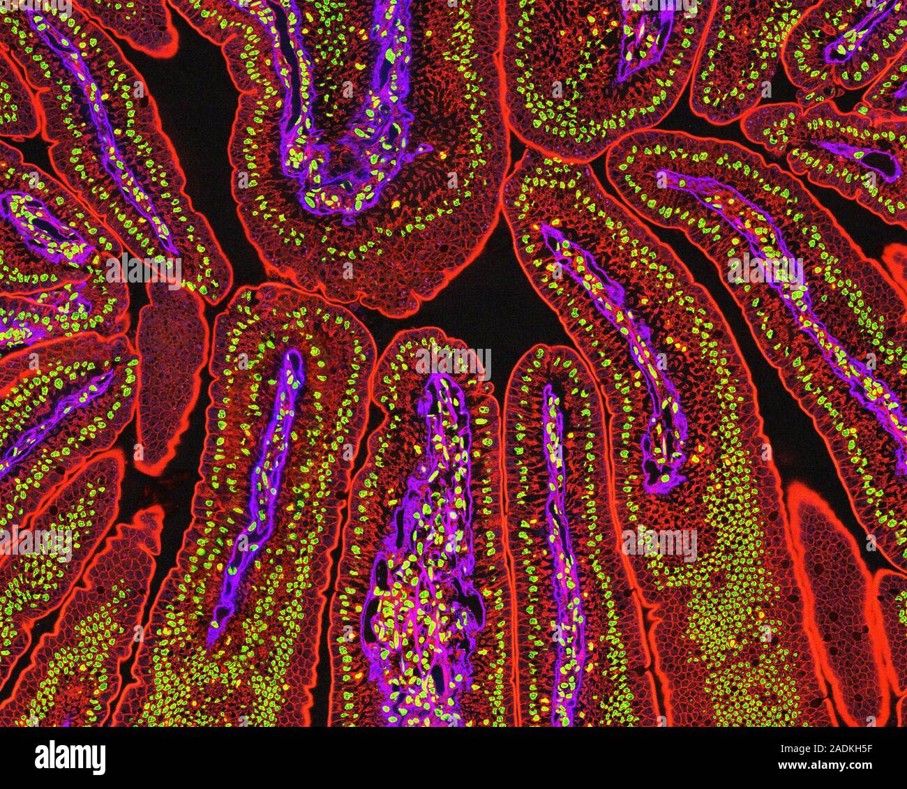 Villi in the small intestine, fluorescent light micrograph. Villi are ...