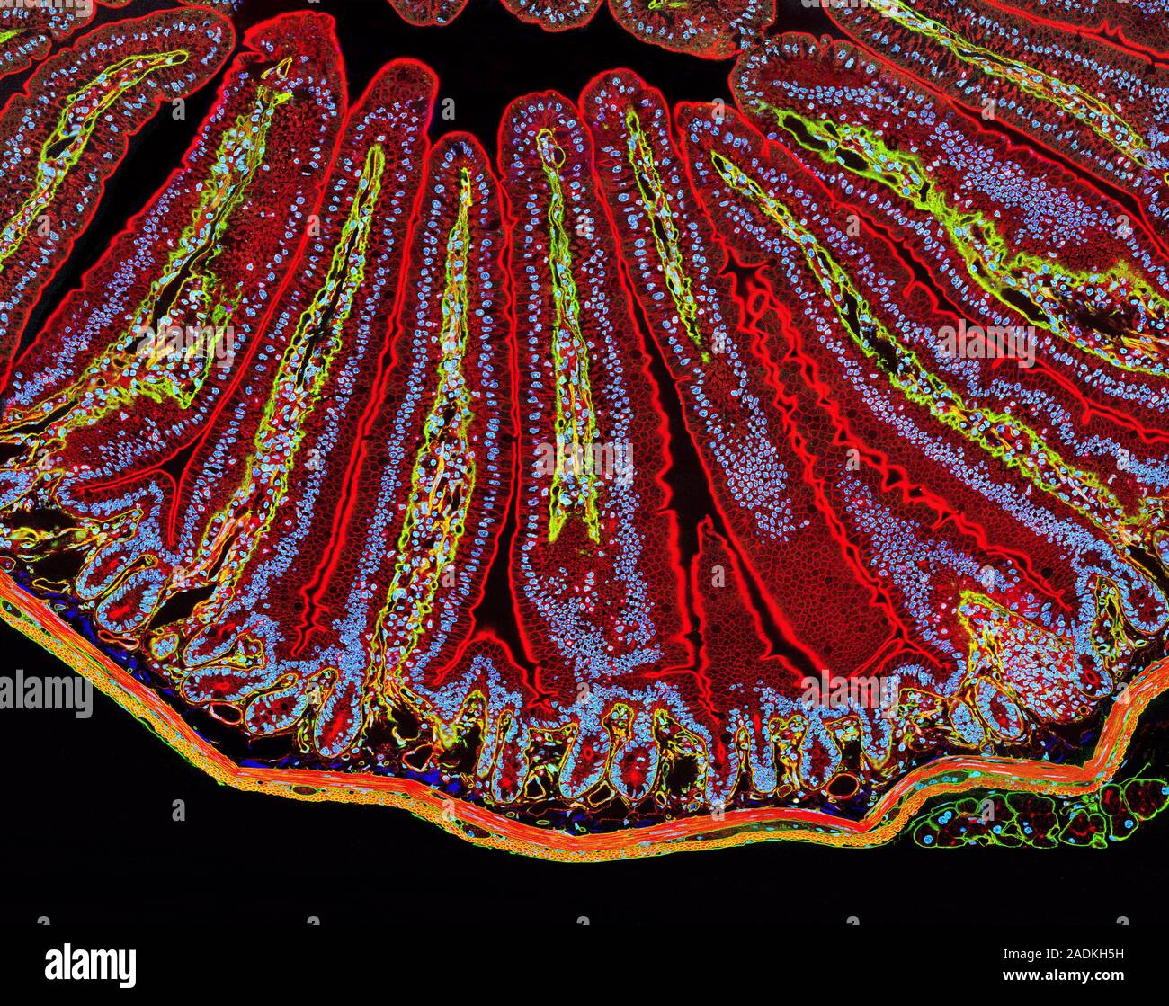 Villi in the small intestine, fluorescent light micrograph. Villi are ...