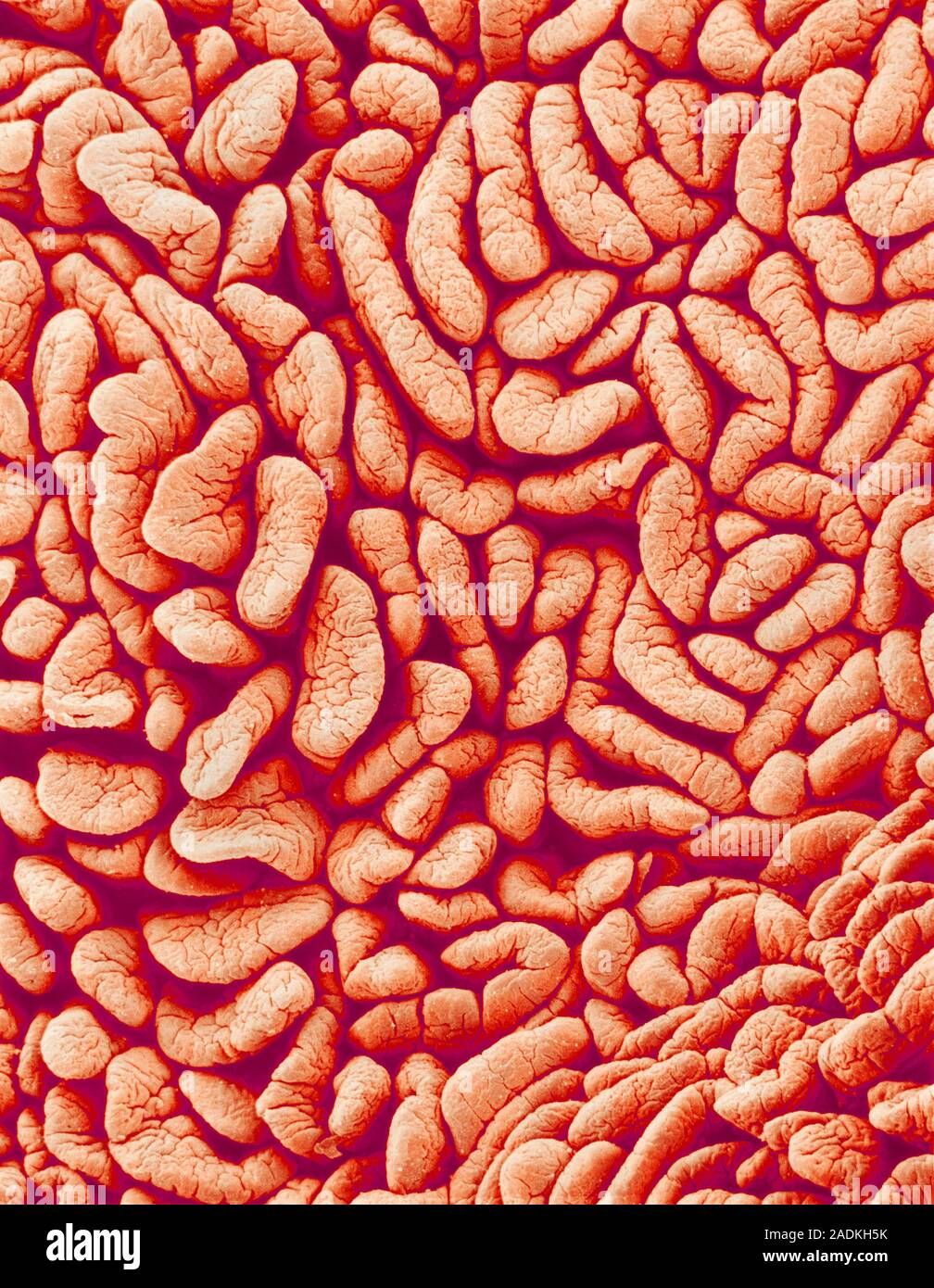 Intestinal lining. Coloured scanning electron micrograph (SEM) of villi ...