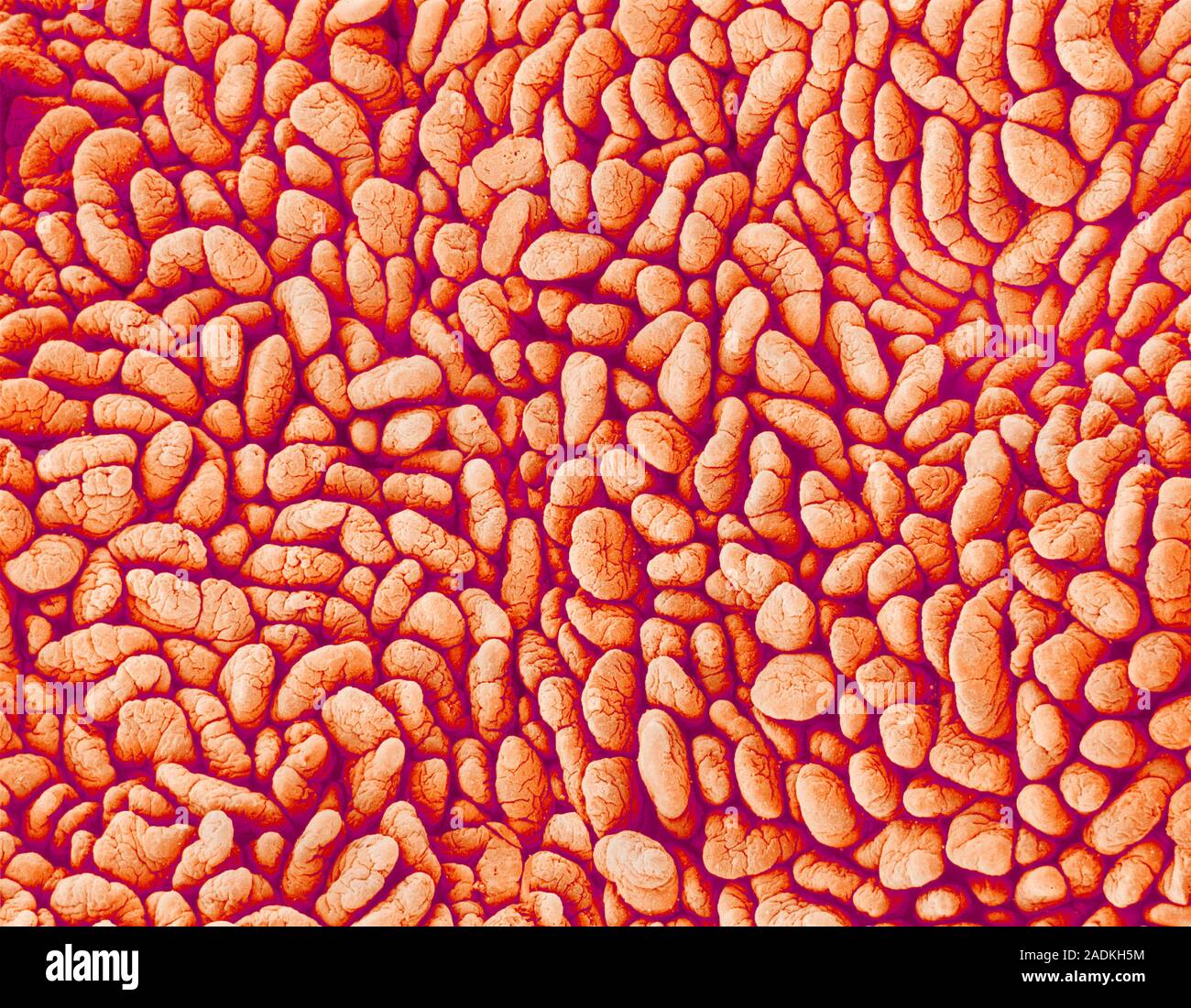 Intestinal lining. Coloured scanning electron micrograph (SEM) of villi ...