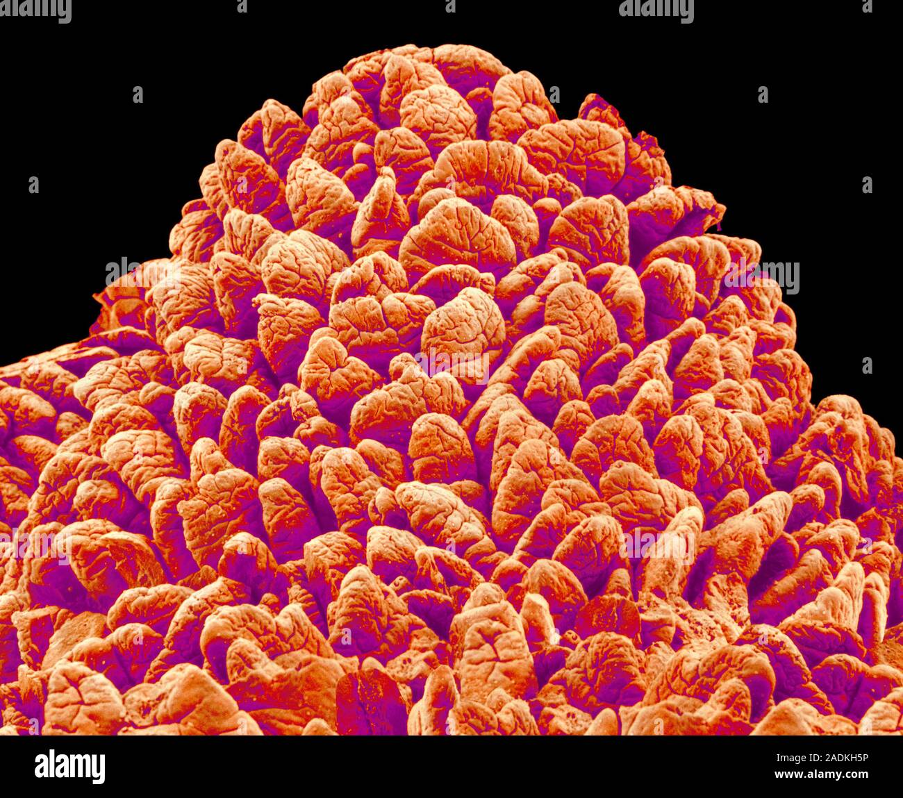 Intestinal lining. Coloured scanning electron micrograph (SEM) of villi ...