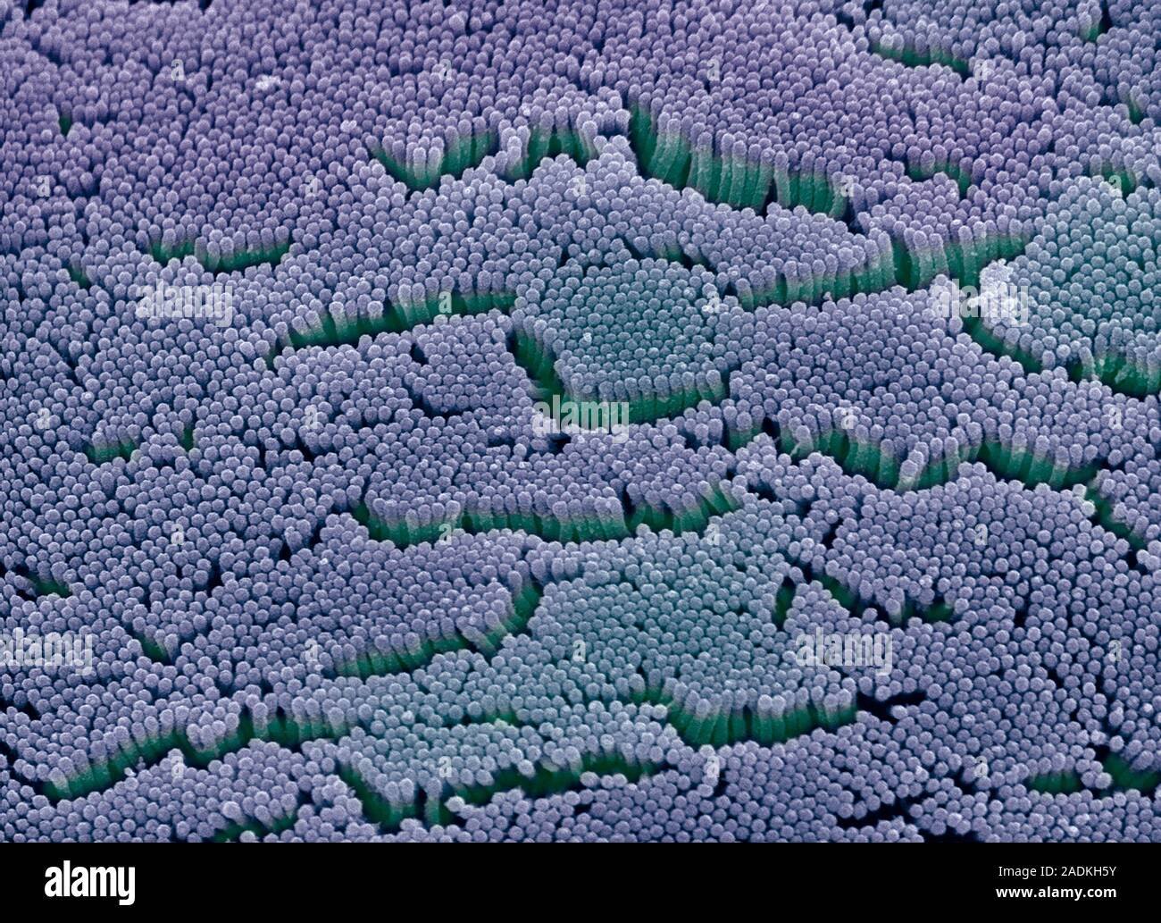 Intestinal microvilli. Coloured scanning electron micrograph (SEM) of ...