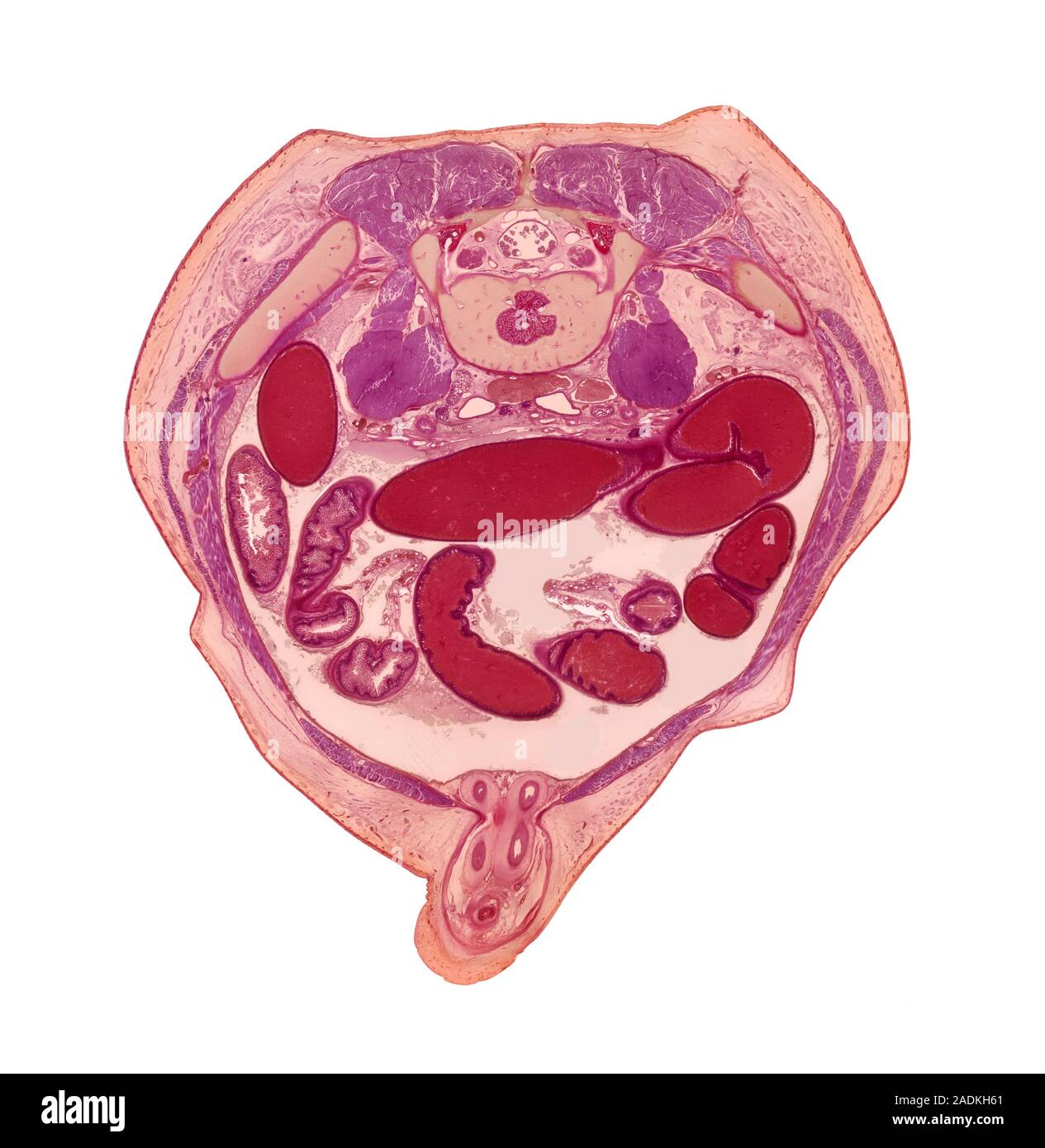 Foetal small intestines. Macro photograph of a section through the ...