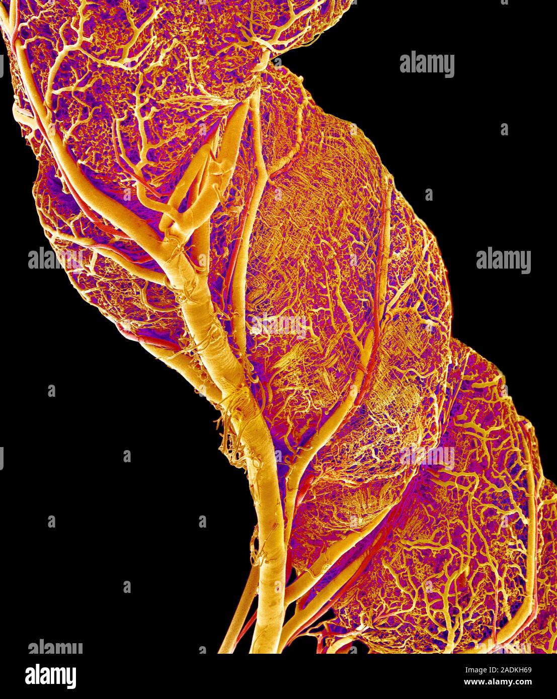 Small intestine blood vessels. Coloured scanning electron micrograph ...