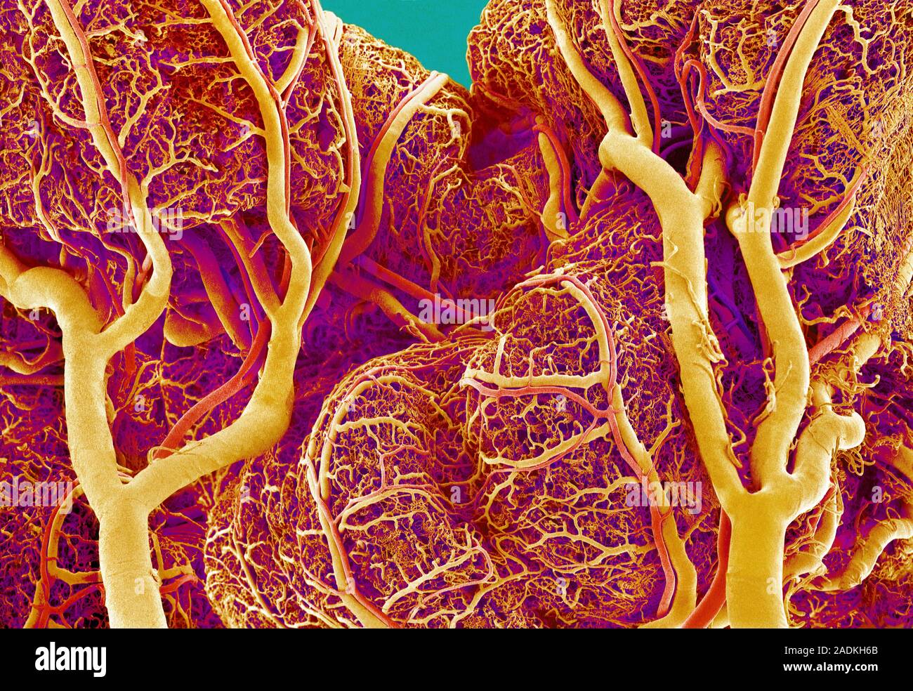 Small intestine blood vessels. Coloured scanning electron micrograph ...