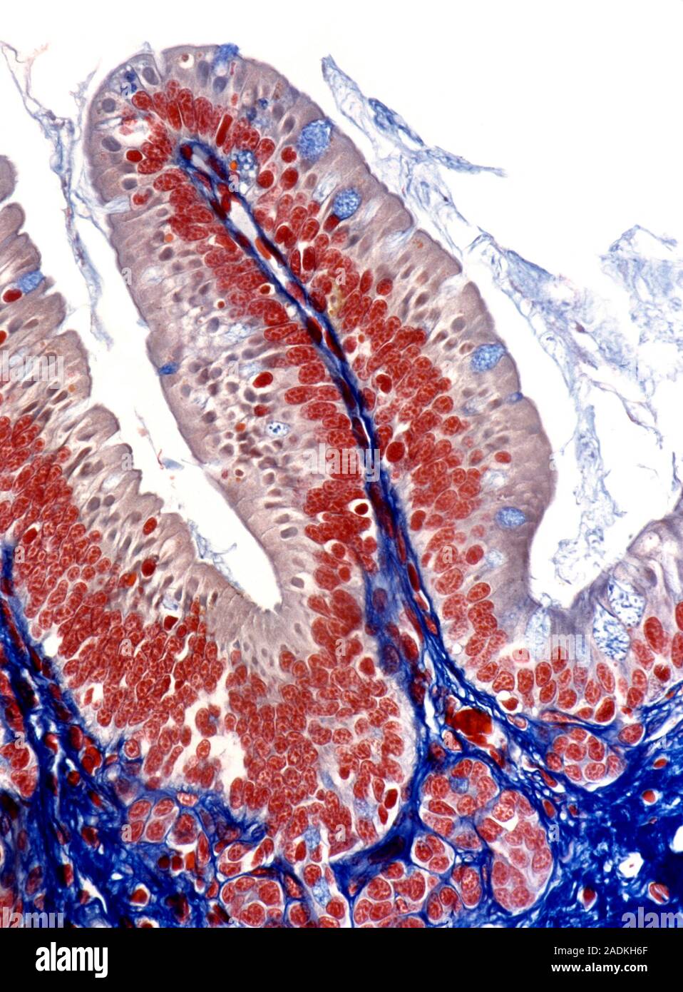 Intestinal villus. Coloured light micrograph of a section through the ...