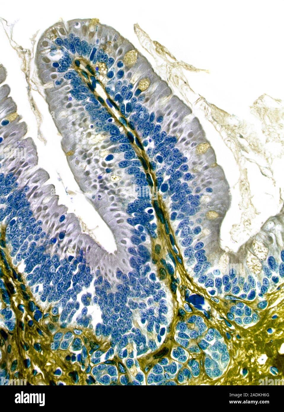 Intestinal villus. Coloured light micrograph of a section through the ...